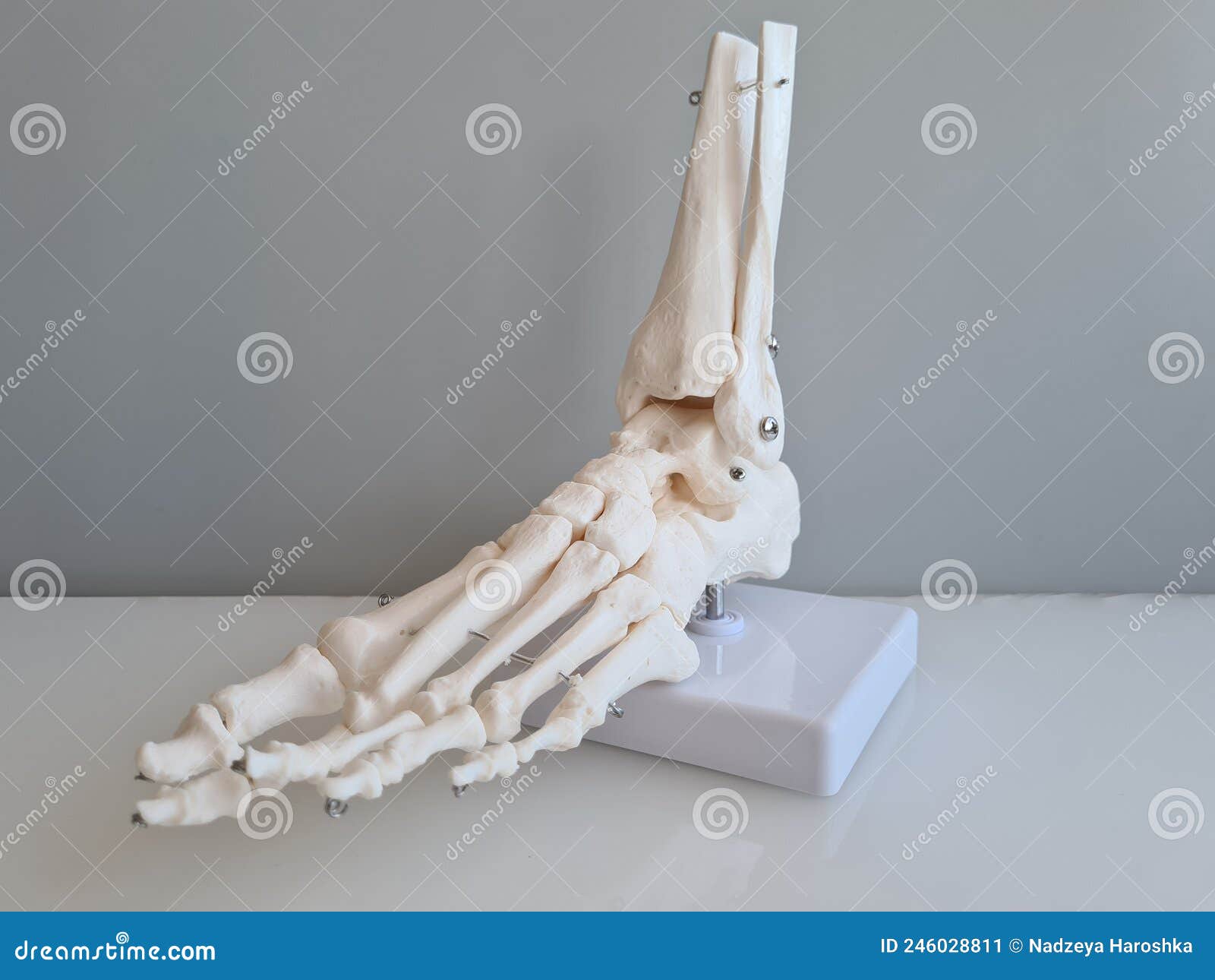 Medical Anatomy of Foot Skeleton. Disease Structures of Foot and Toes ...
