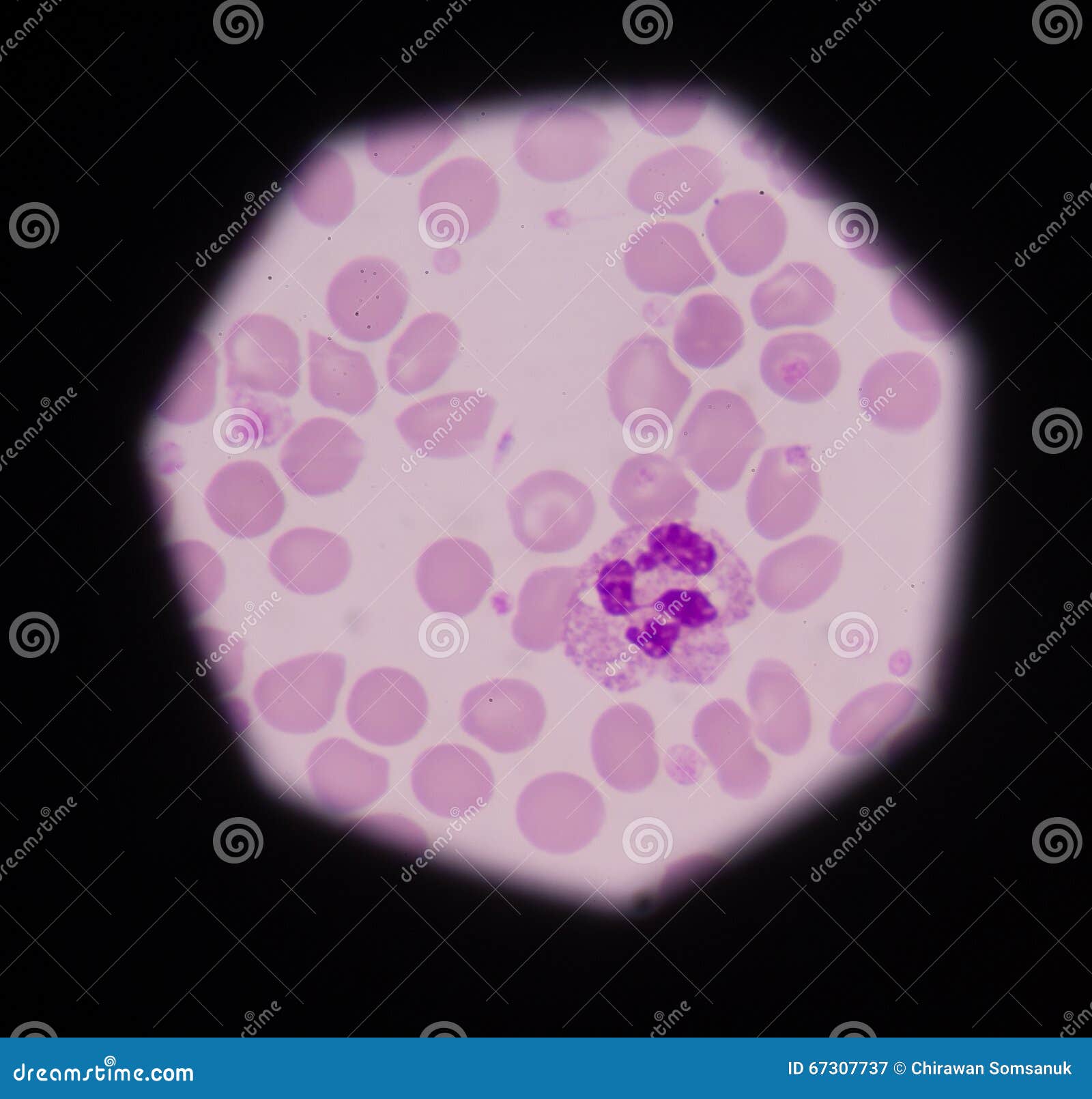 Medical background stock image. Image of leukocyte, eosinophil - 67307737