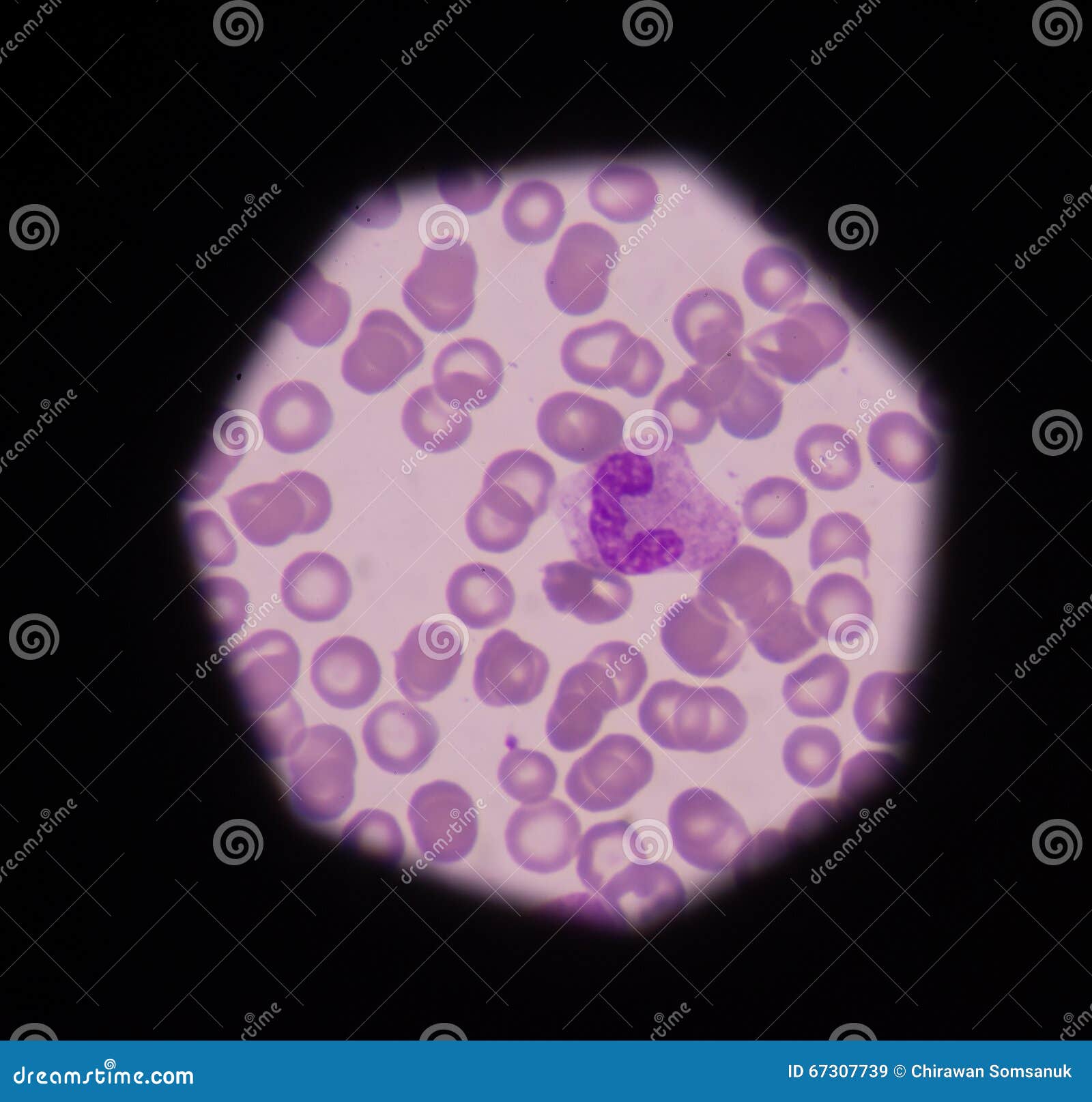 Medical background stock image. Image of lymphocyte, laboratory - 67307739