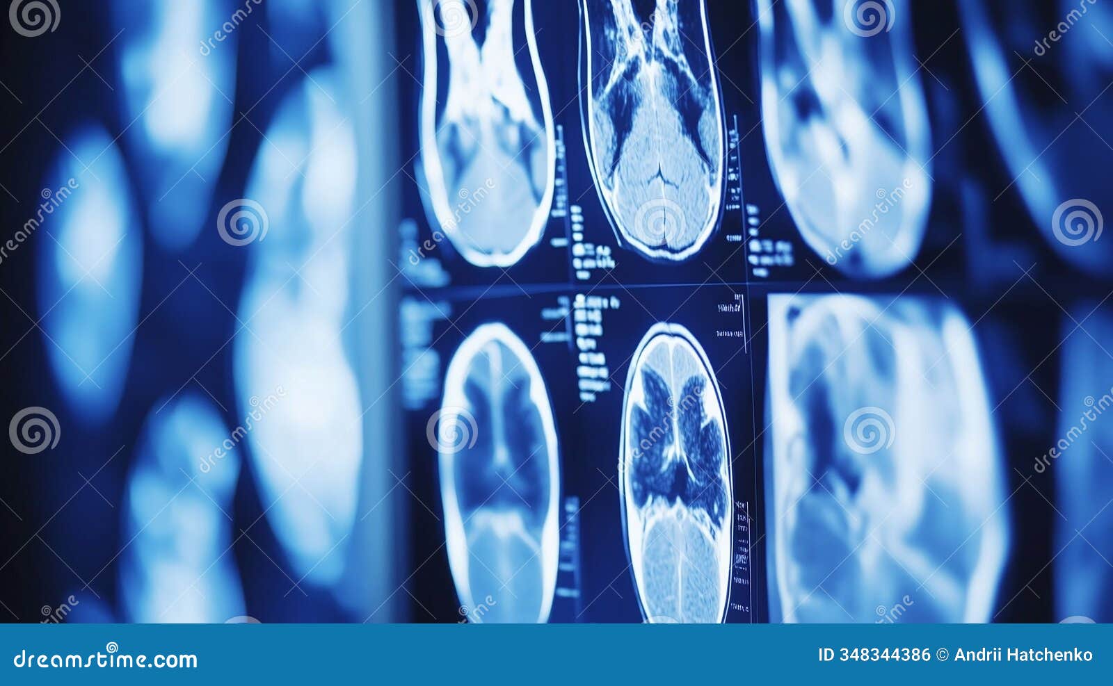 Medical Device that Utilizes Deep Learning Algorithms and Computer ...