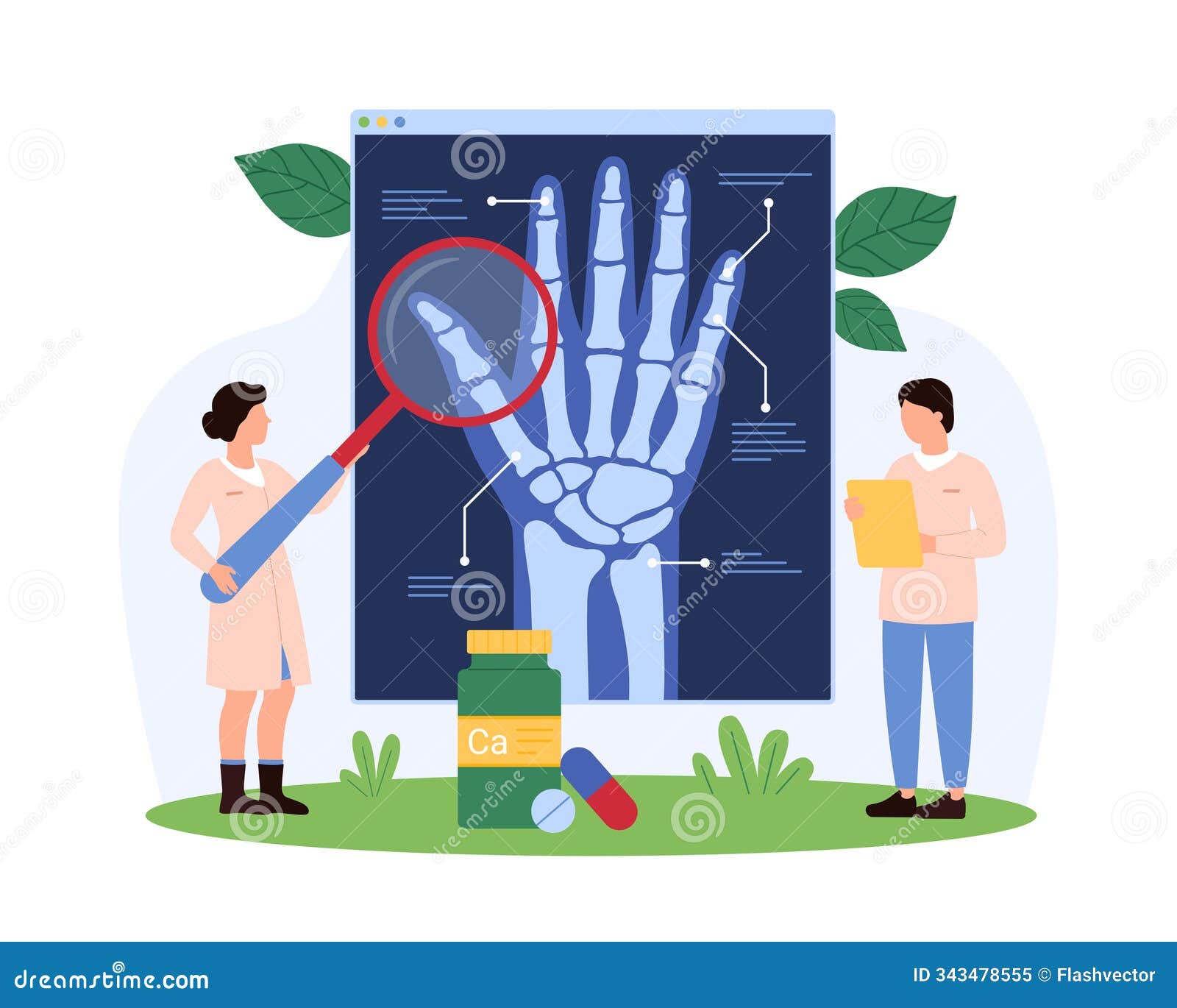 Hand Joints Of A Man. Concept Of Rheumatic Arthritis, Rheumatism, Gout ...