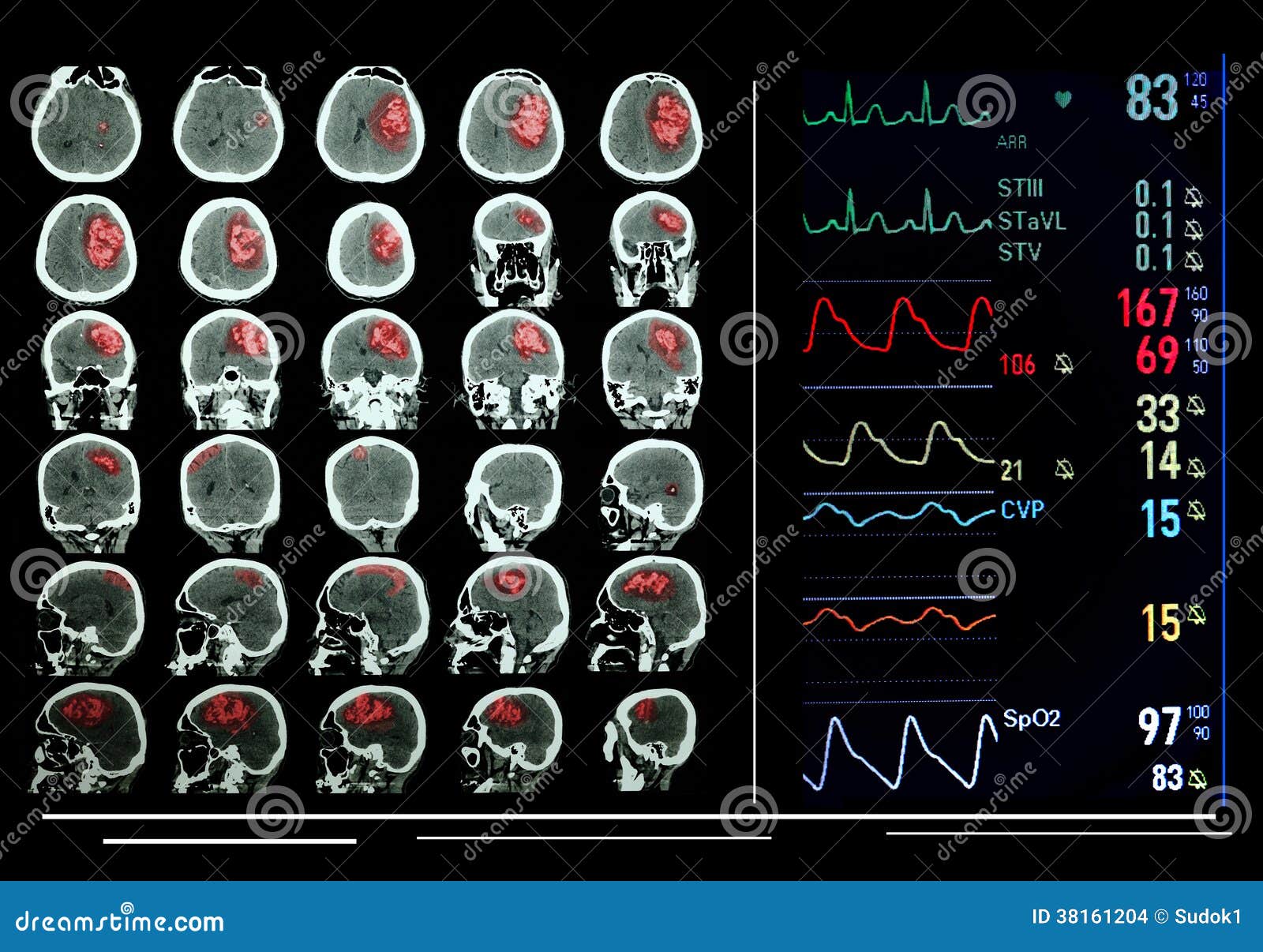 Medical Fields Screen Monitor. Stock Photo - Image of health, advanced ...