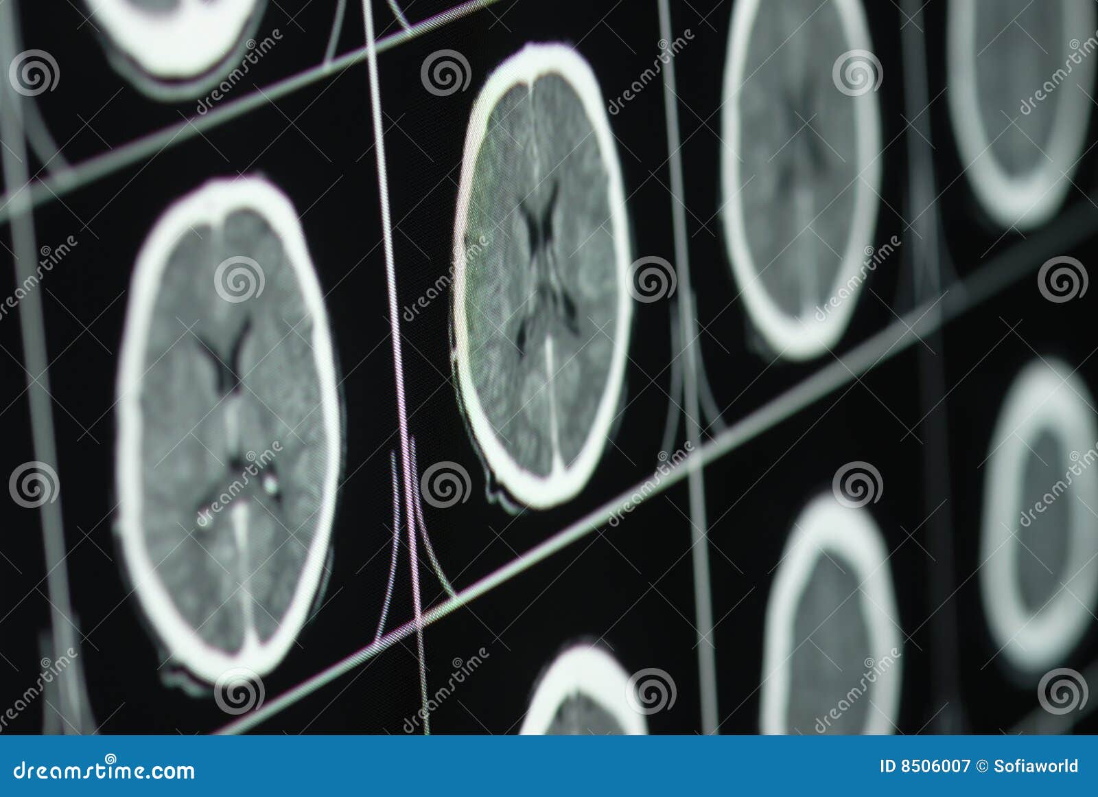 Medical graph stock image. Image of medical, graph, chart - 8506007