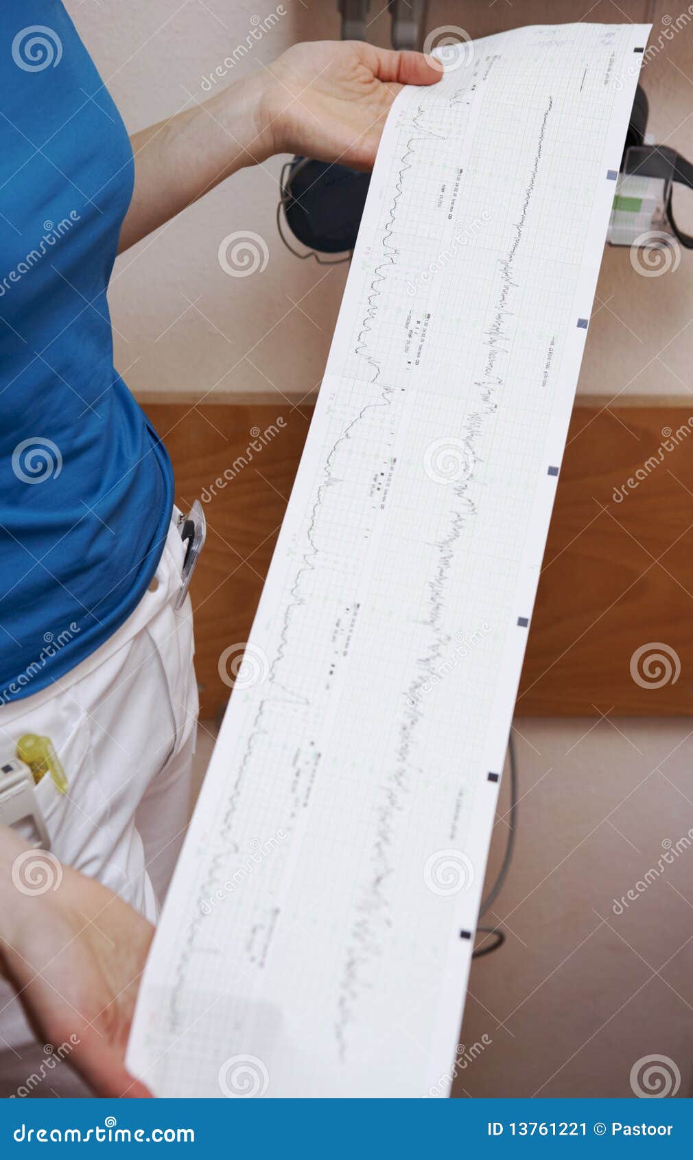 Medical Graph of Contractions Stock Image - Image of examination ...
