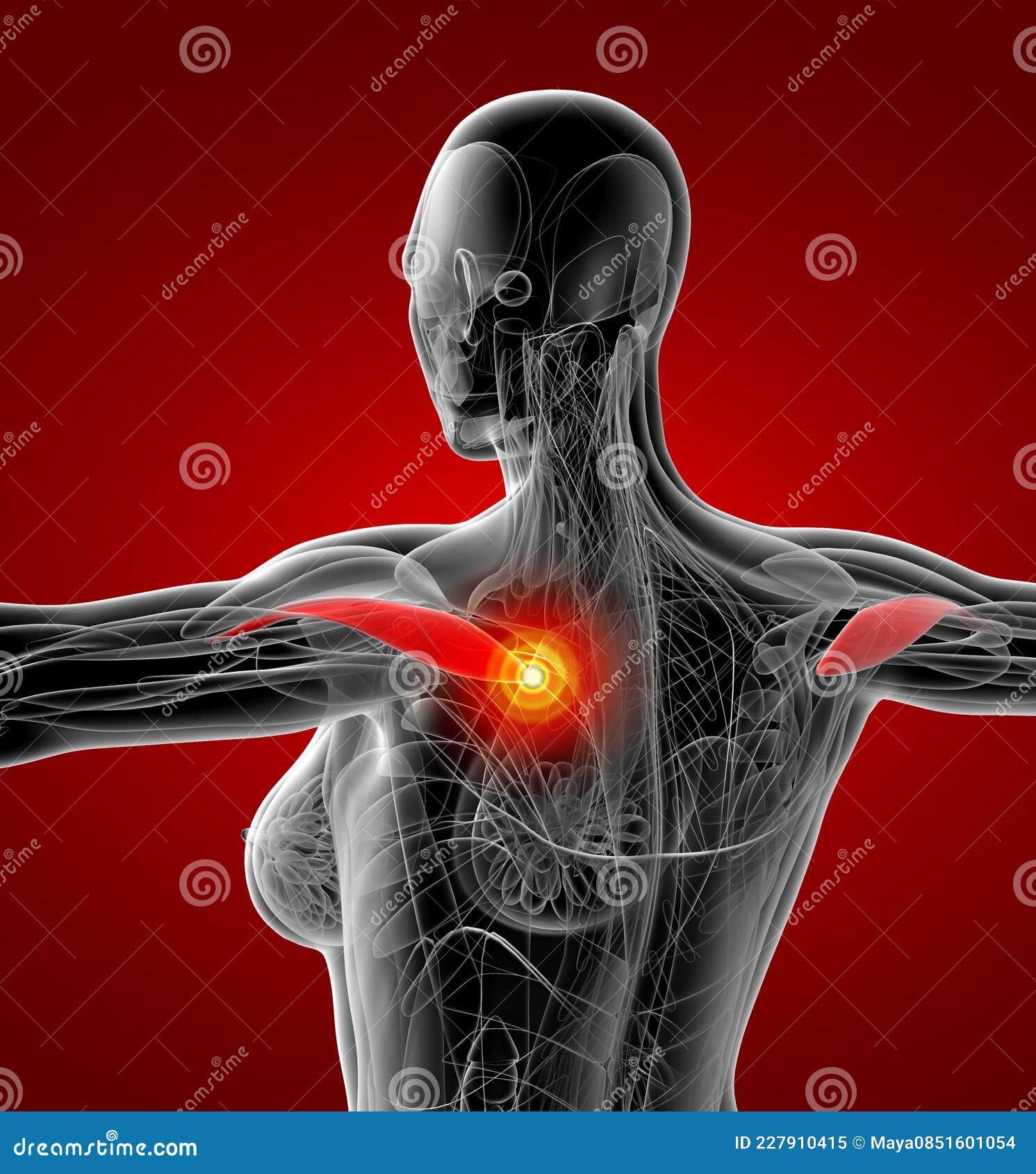Medical Illustration of the Deltoid Stock Illustration - Illustration ...