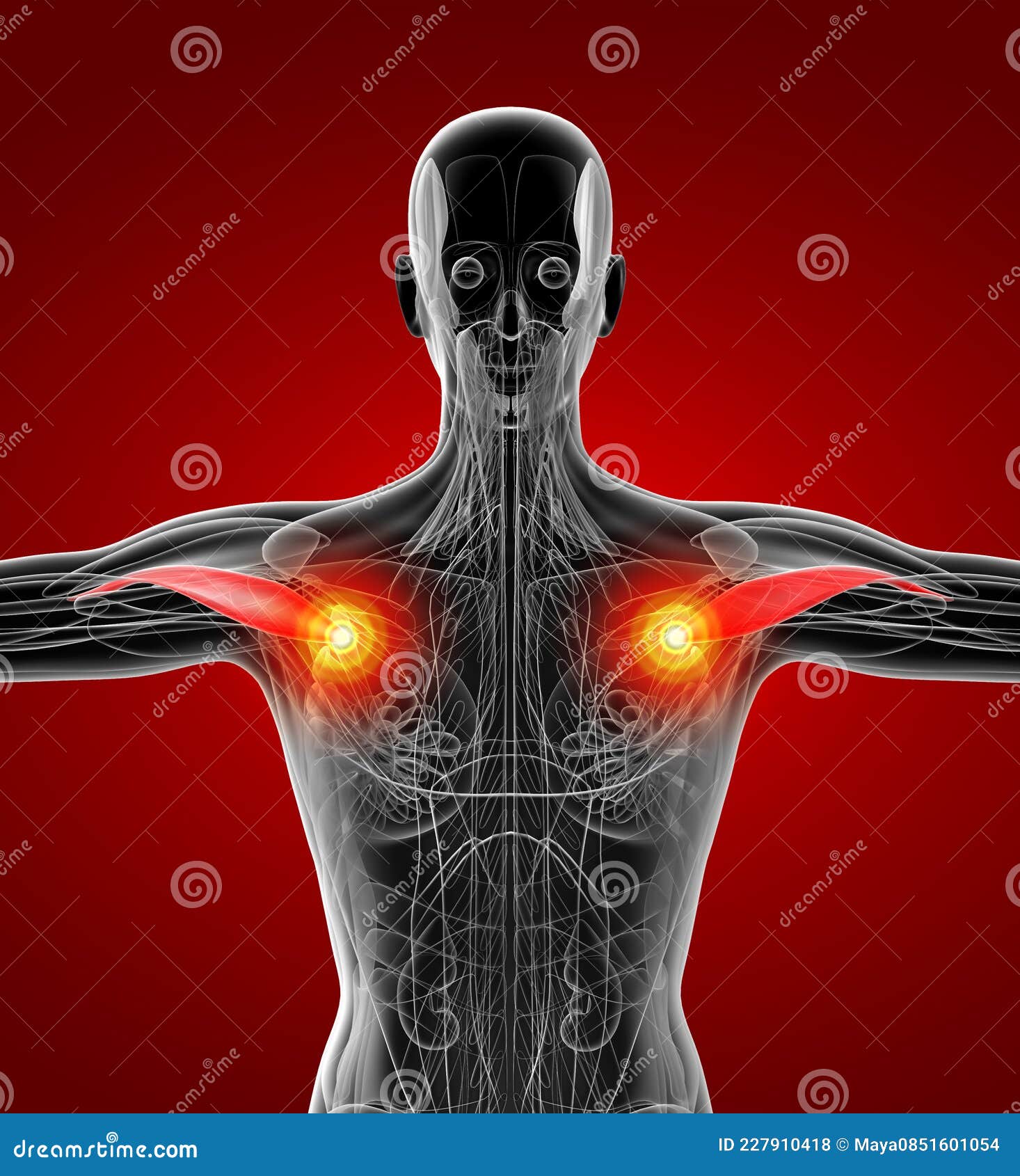 Medical Illustration of the Deltoid Stock Illustration - Illustration ...