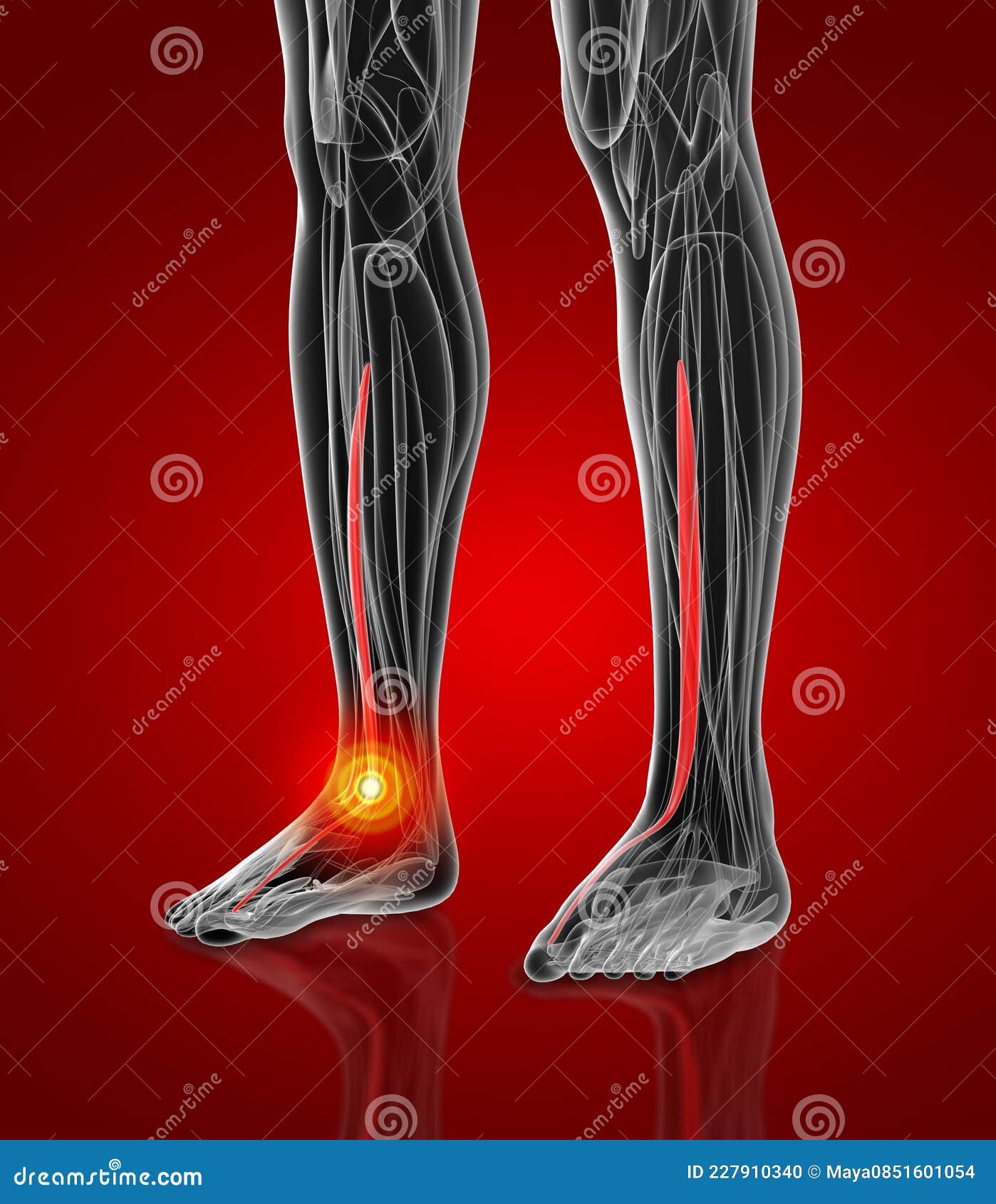 Medical Illustration of the Extensor Hallucis Longus Stock Illustration ...