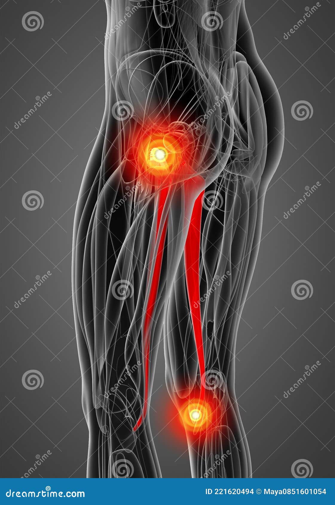 3d Illustration Of The Gracilis Muscles Anatomical Position On Xray ...