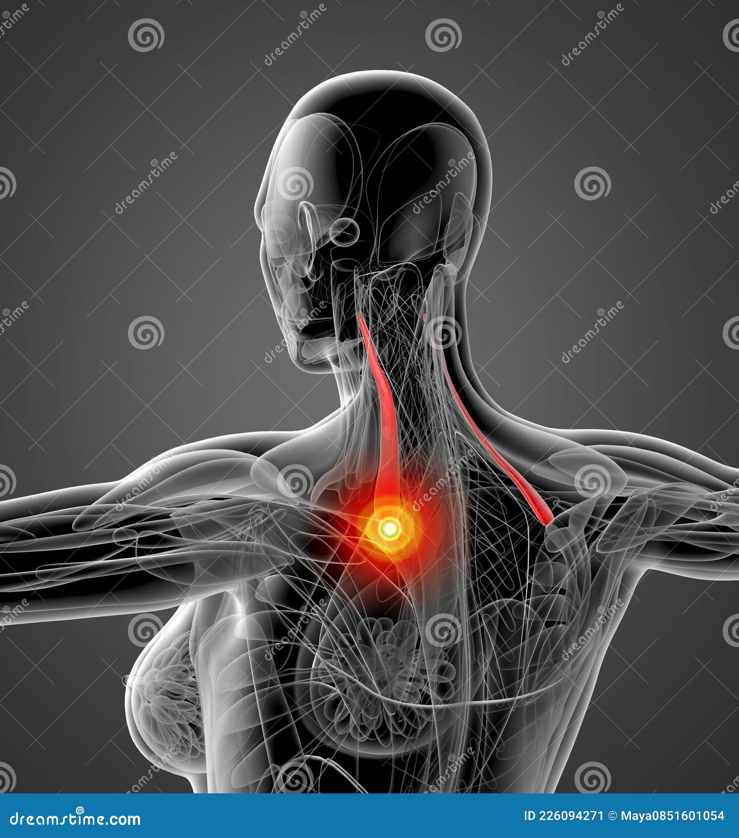 Medical Illustration of the Levator Scapulae Stock Illustration ...
