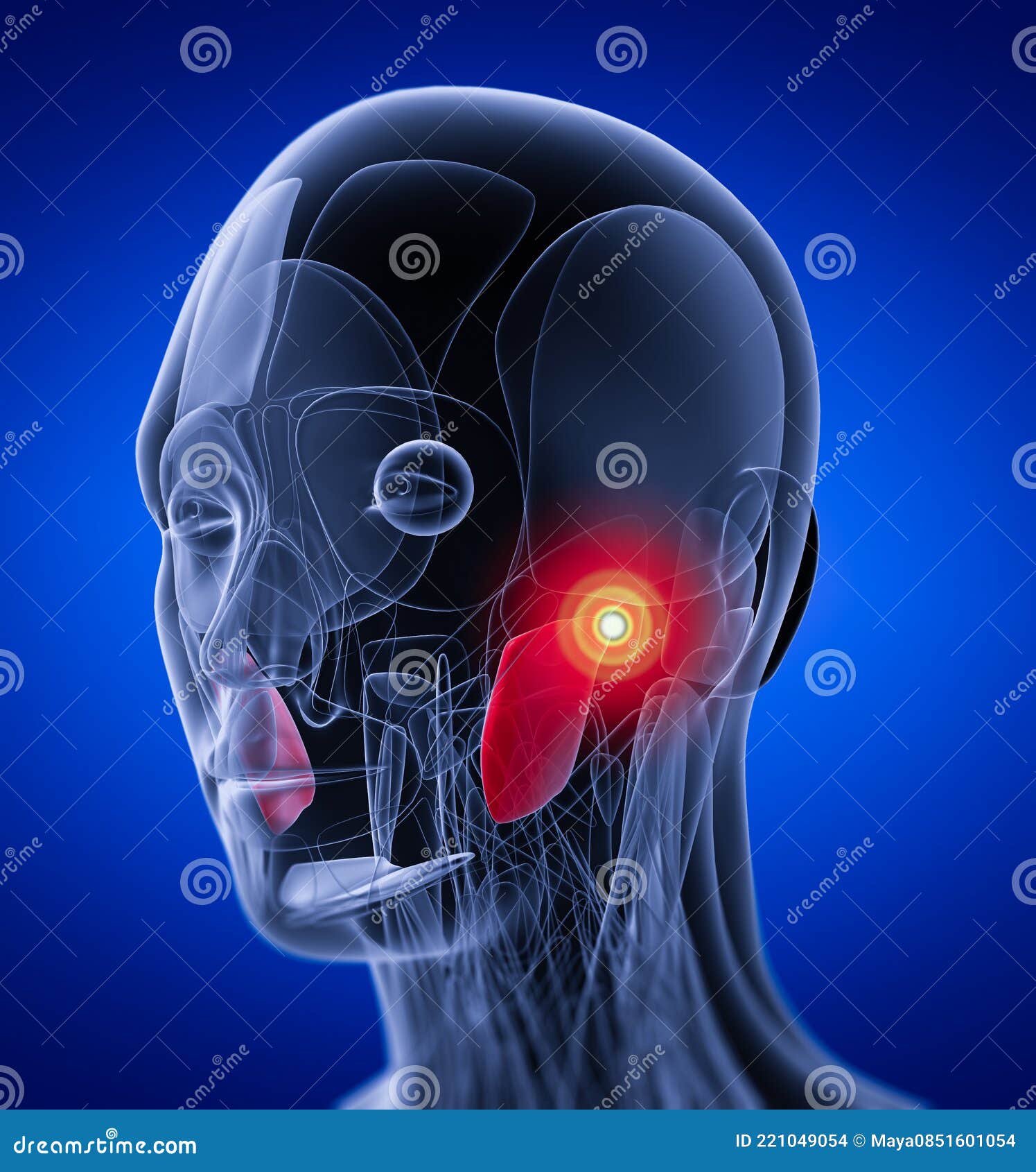 Medical Illustration of the Masseter Stock Illustration - Illustration ...