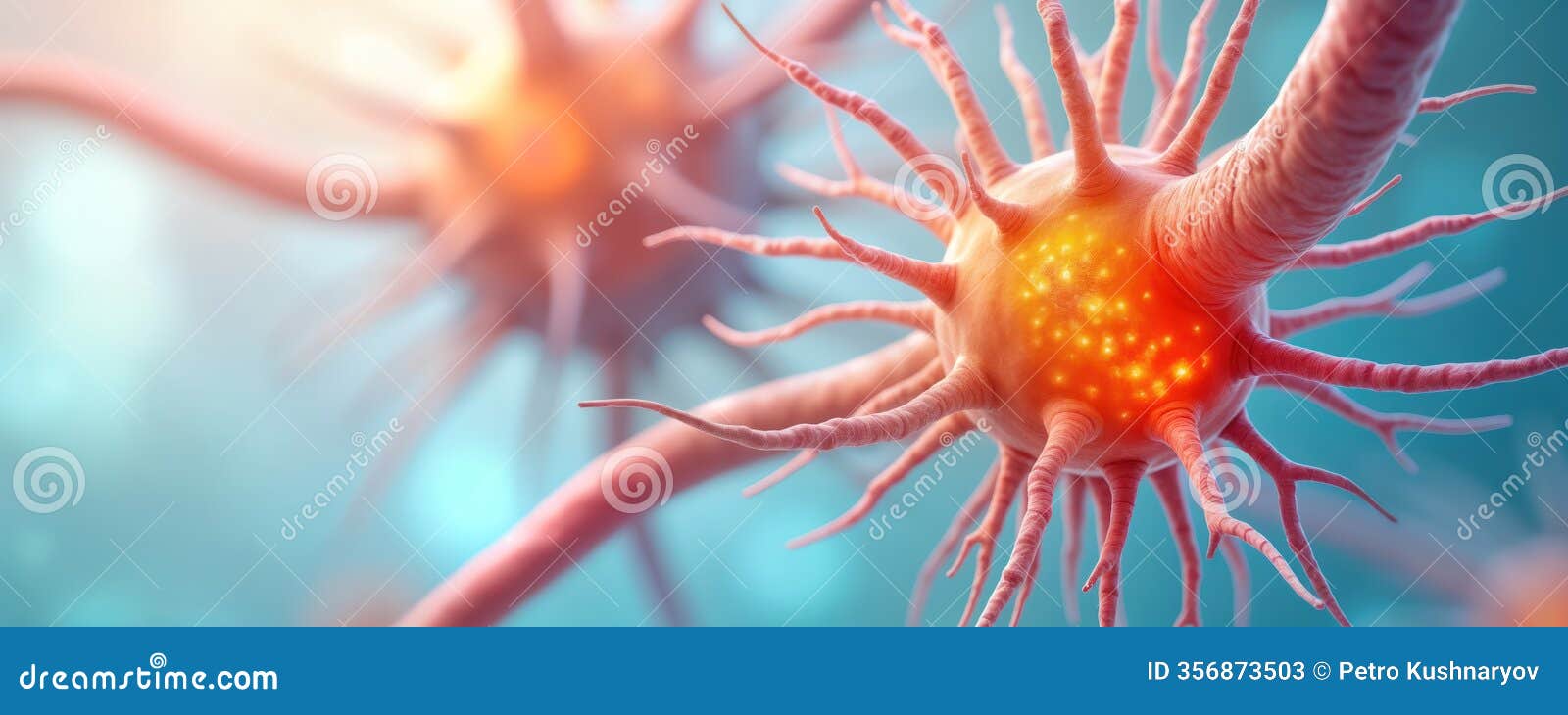 Medical Illustration Shows Nerve Cells with Inflammation. Nerve Damage ...