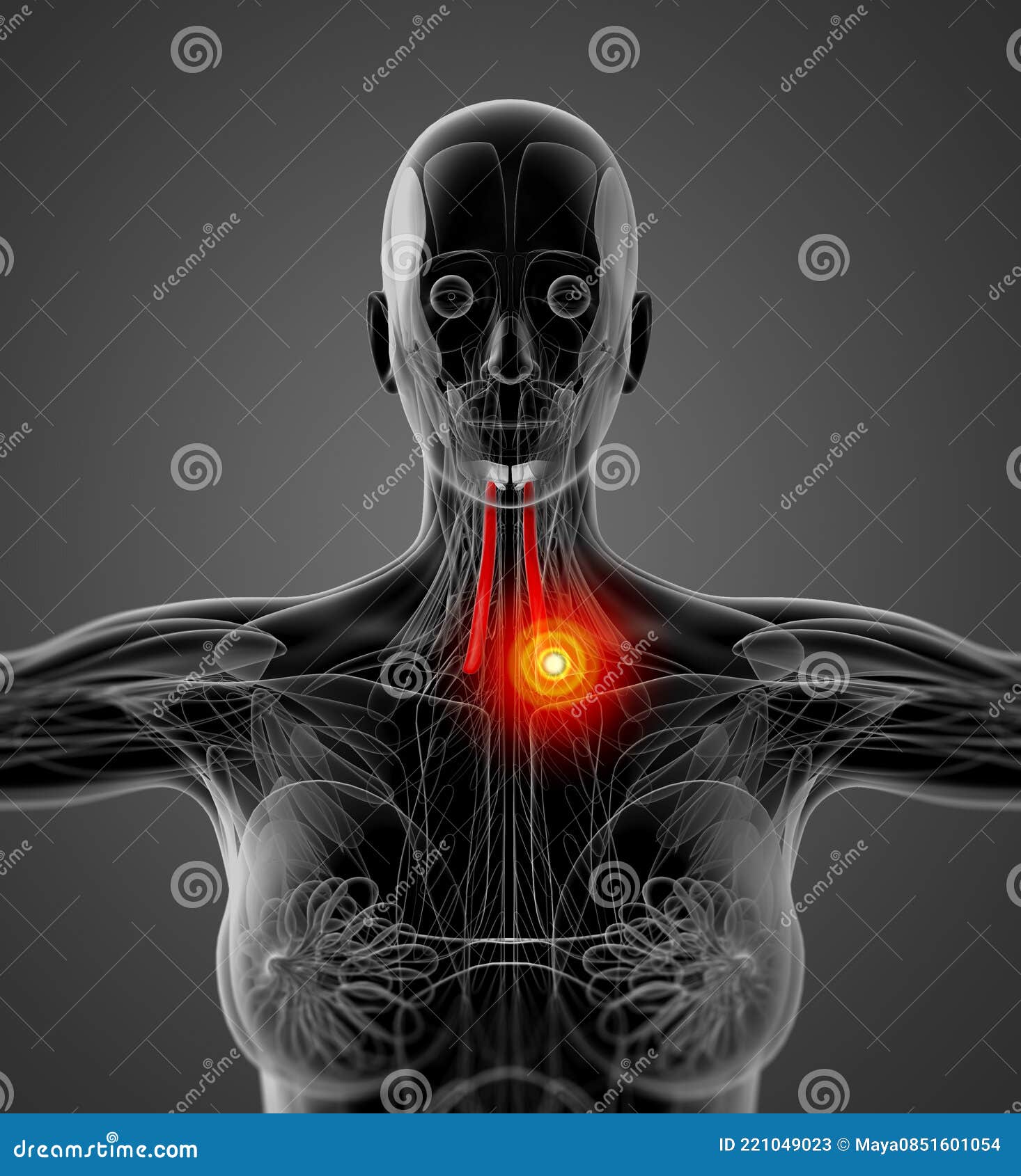 3d Illustration Of Sternohyoid Muscles On Xray Musculature Royalty-Free ...