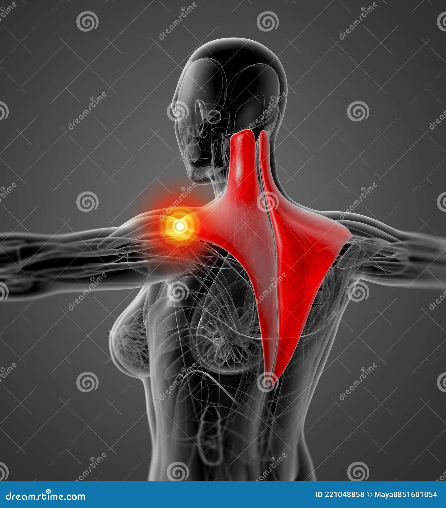 3D Illustration Of Trapezius Part Of Muscle Anatomy. Stock Photo ...
