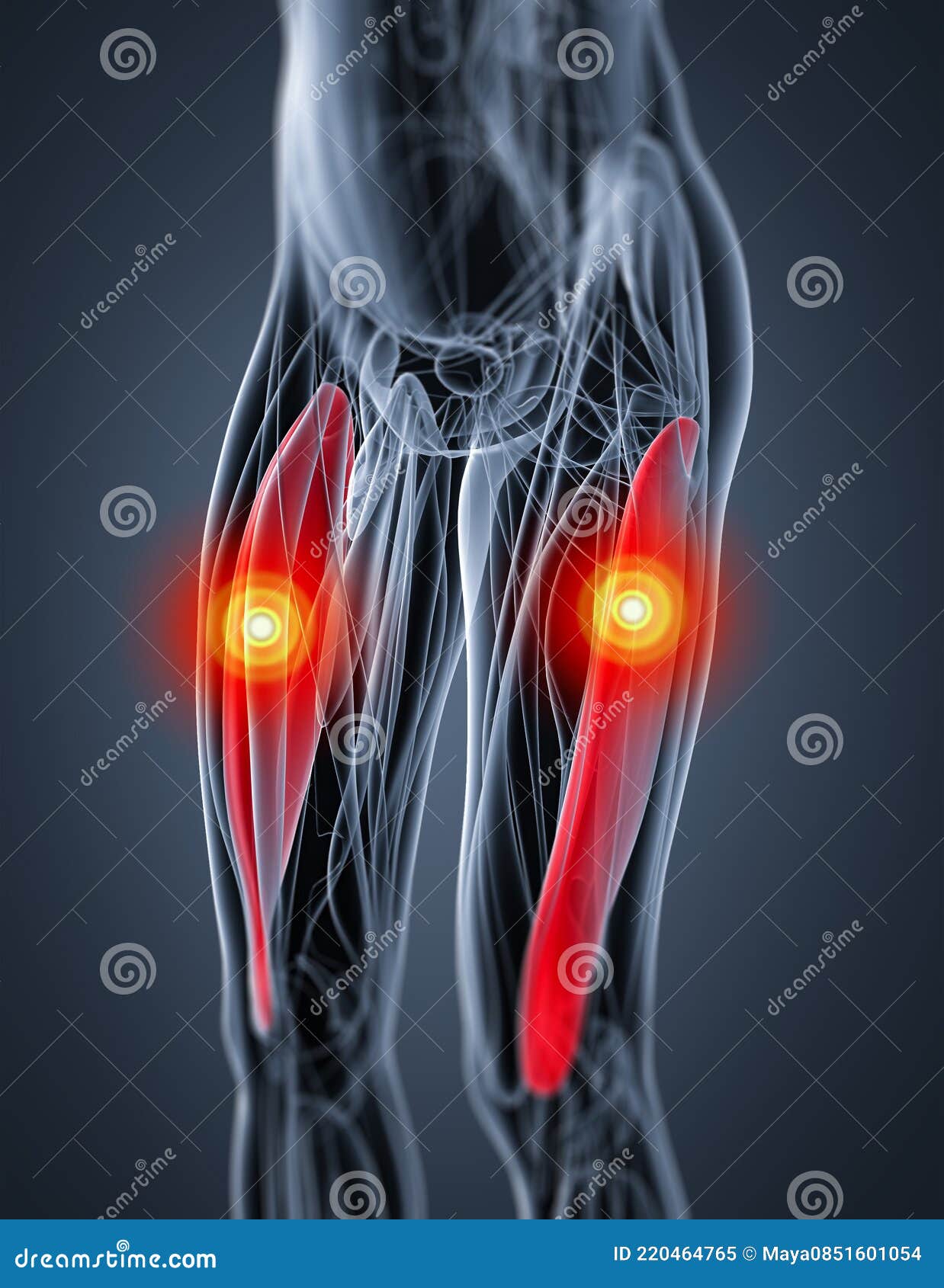 Medical Illustration of the Vastus Lateralis Stock Illustration ...