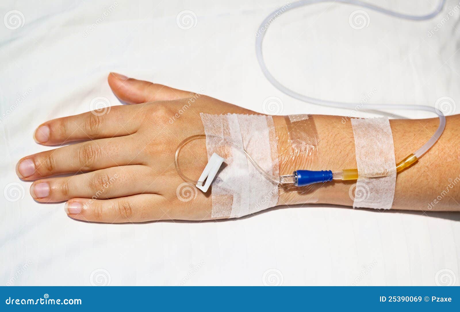 Medical Intravenous Cannula on Hand Stock Image - Image of healthcare ... Medical Intravenous Cannula on Hand Stock Image - Image of healthcare ...