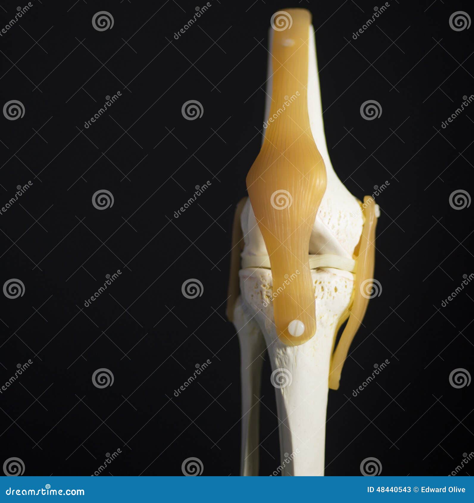 Medical Knee Joint Meniscus Plastic Demonstration Teaching Model Stock ...