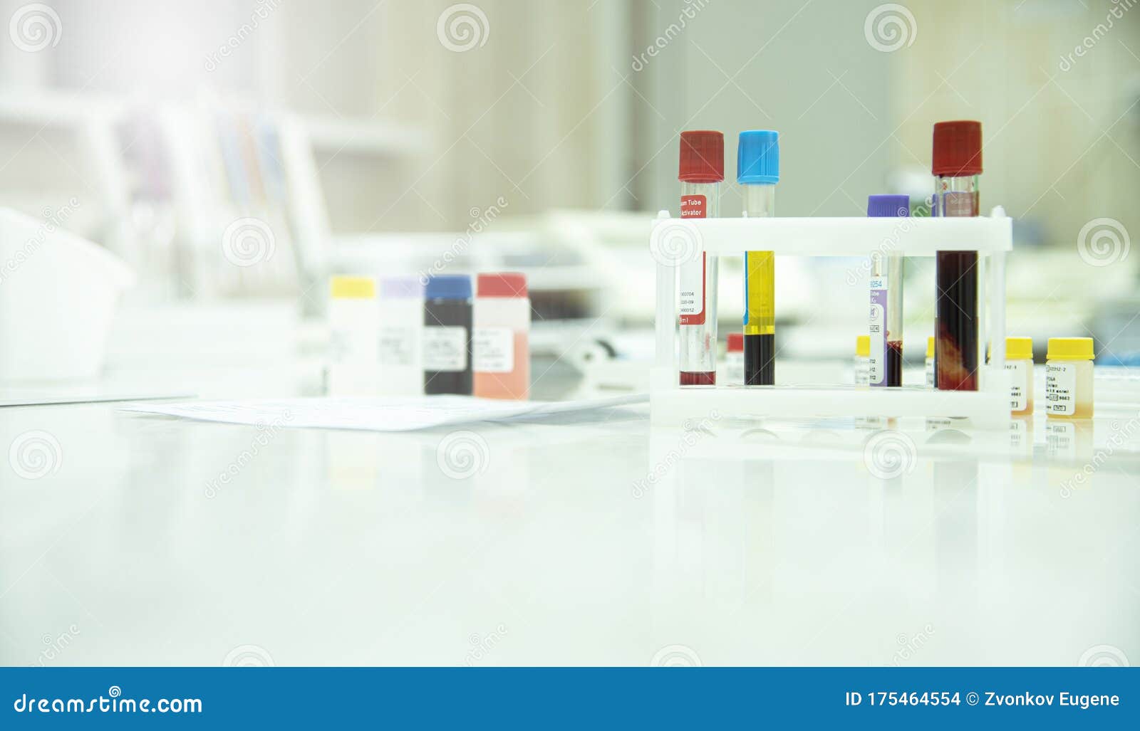 Medical Lab Equipment. Blood Test Medical Concept Stock Photo - Image ...