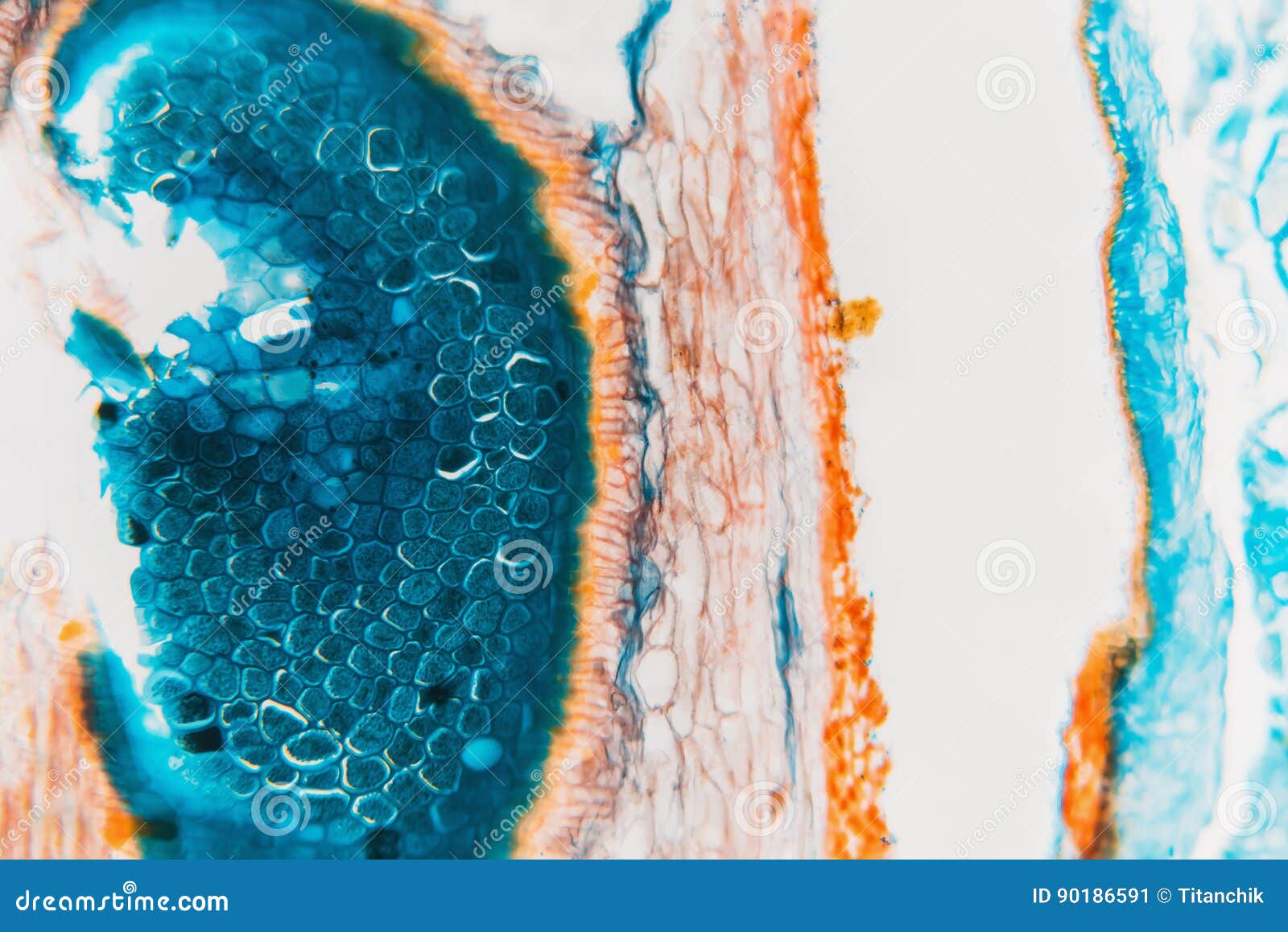 Medical Lab Prepared Microscopic- Weevil Rye Stock Image - Image of ...