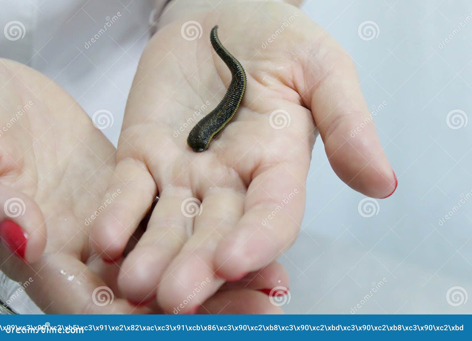 Medical Leech on the Doctor& X27;s Gloved Hand. Stock Image - Image of ...