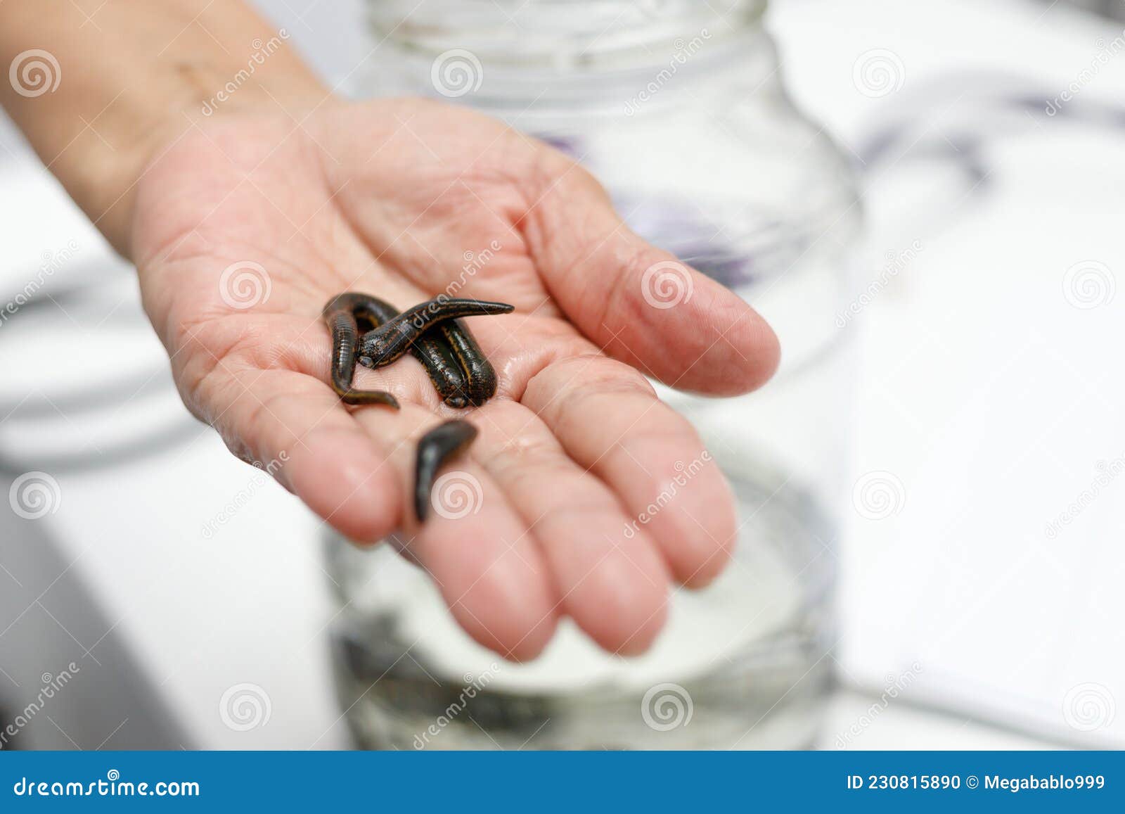 Medical Leeches in the Hand of a Hirudotherapist Stock Photo - Image of ...