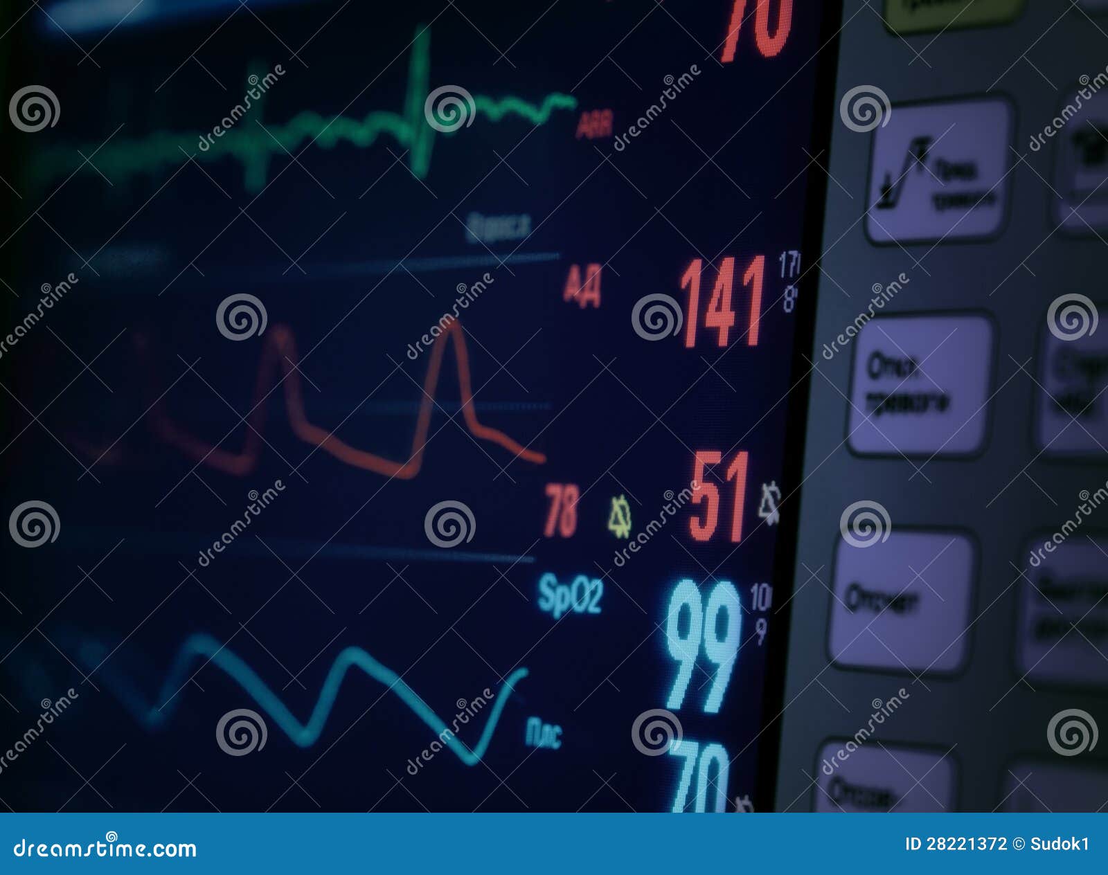 Medical Monitor. stock photo. Image of heartbeat, screen - 28221372