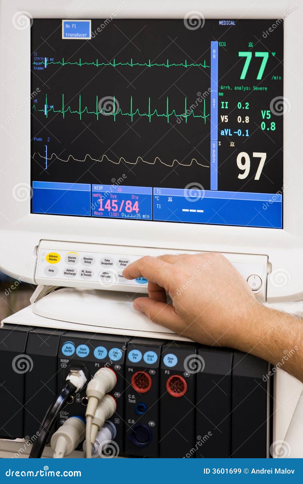 Medical Monitor And The Roentgen Image In The Doctor`s Hand Next To The ...