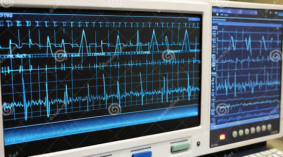 Medical Monitors Displaying Blue Waveforms and Data Patterns Stock ...