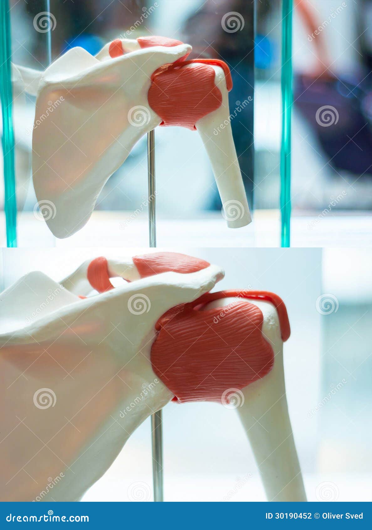Medical Photo of Artificial Muscles Stock Photo - Image of medicine ...