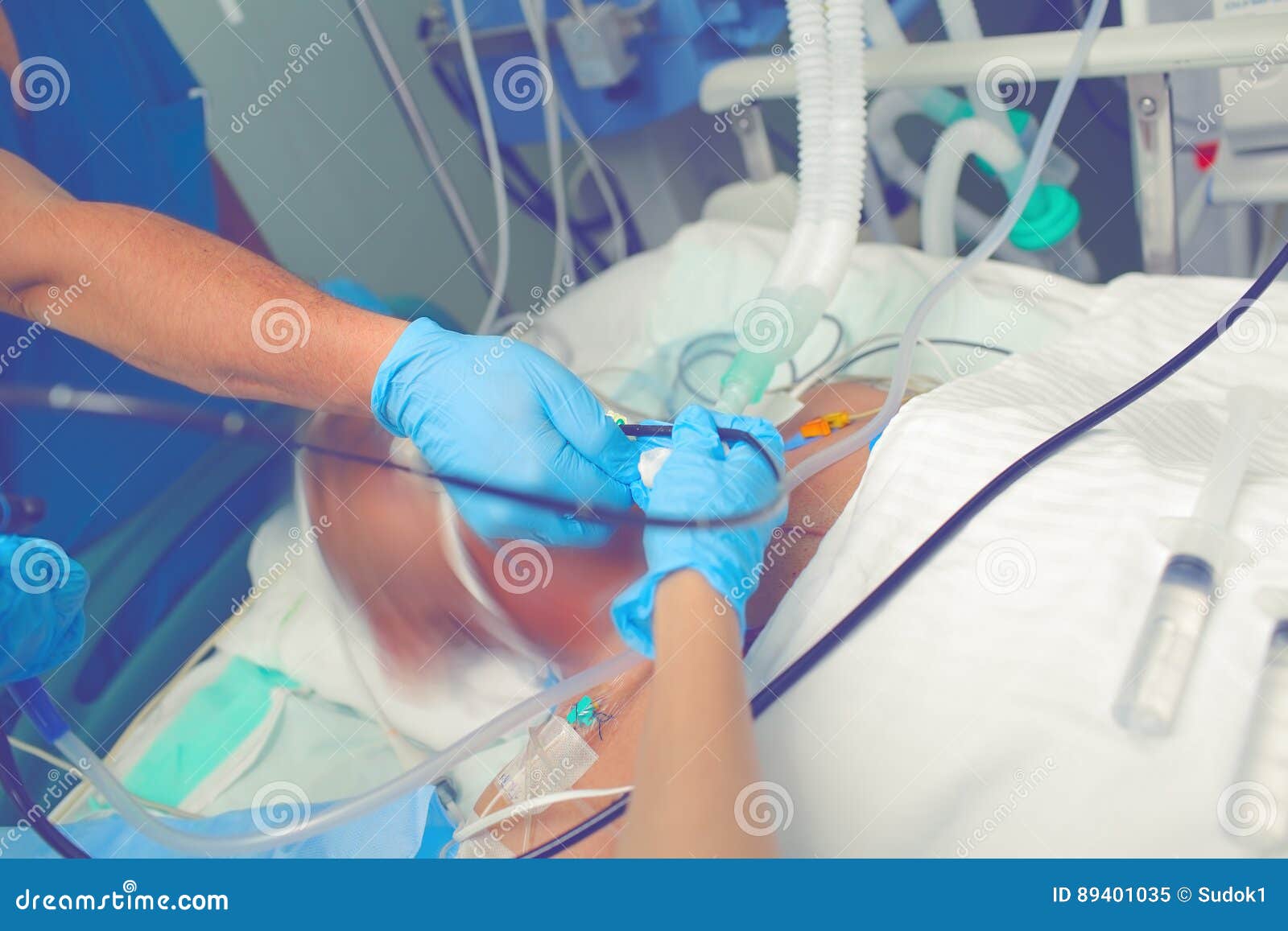 Medical Procedure in the Intensive Care Unit Stock Image - Image of ...