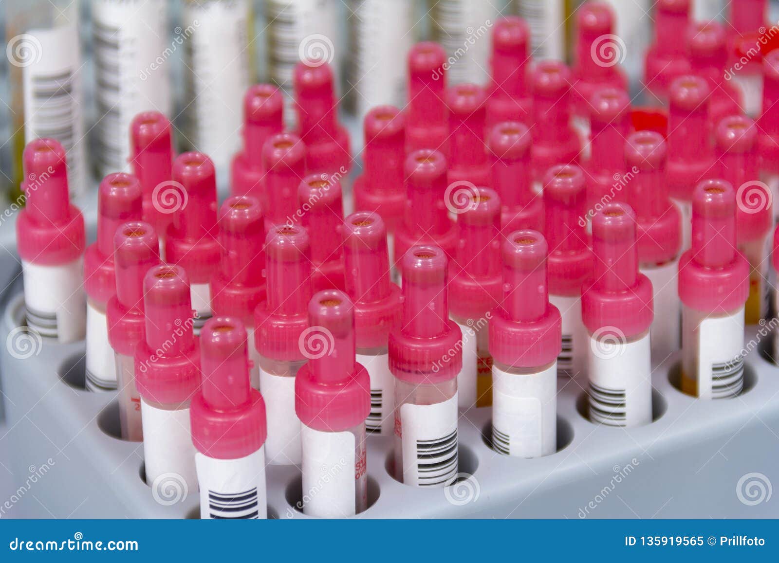 Medical sample racks stock image. Image of result, process - 135919565