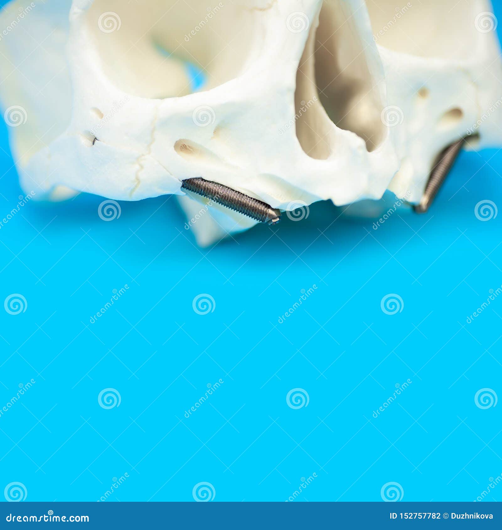 Medical Skull Pattern with False Teeth Pins on Blue Background Stock ...