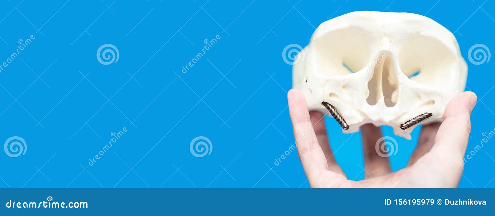 Medical Skull Pattern with False Teeth Pins on Blue Background Stock ...