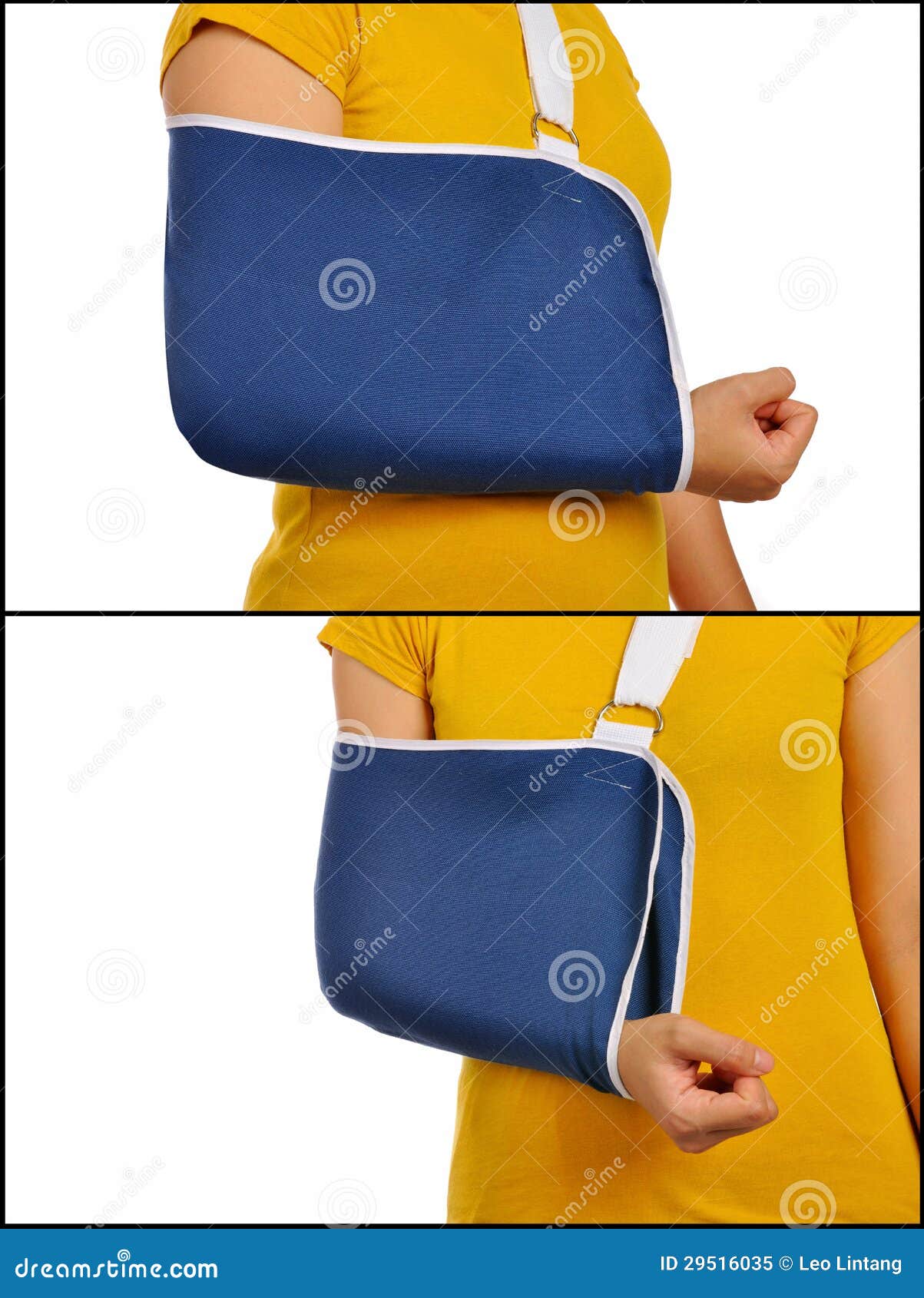 Medical Support Hand Sling stock image. Image of health - 29516035