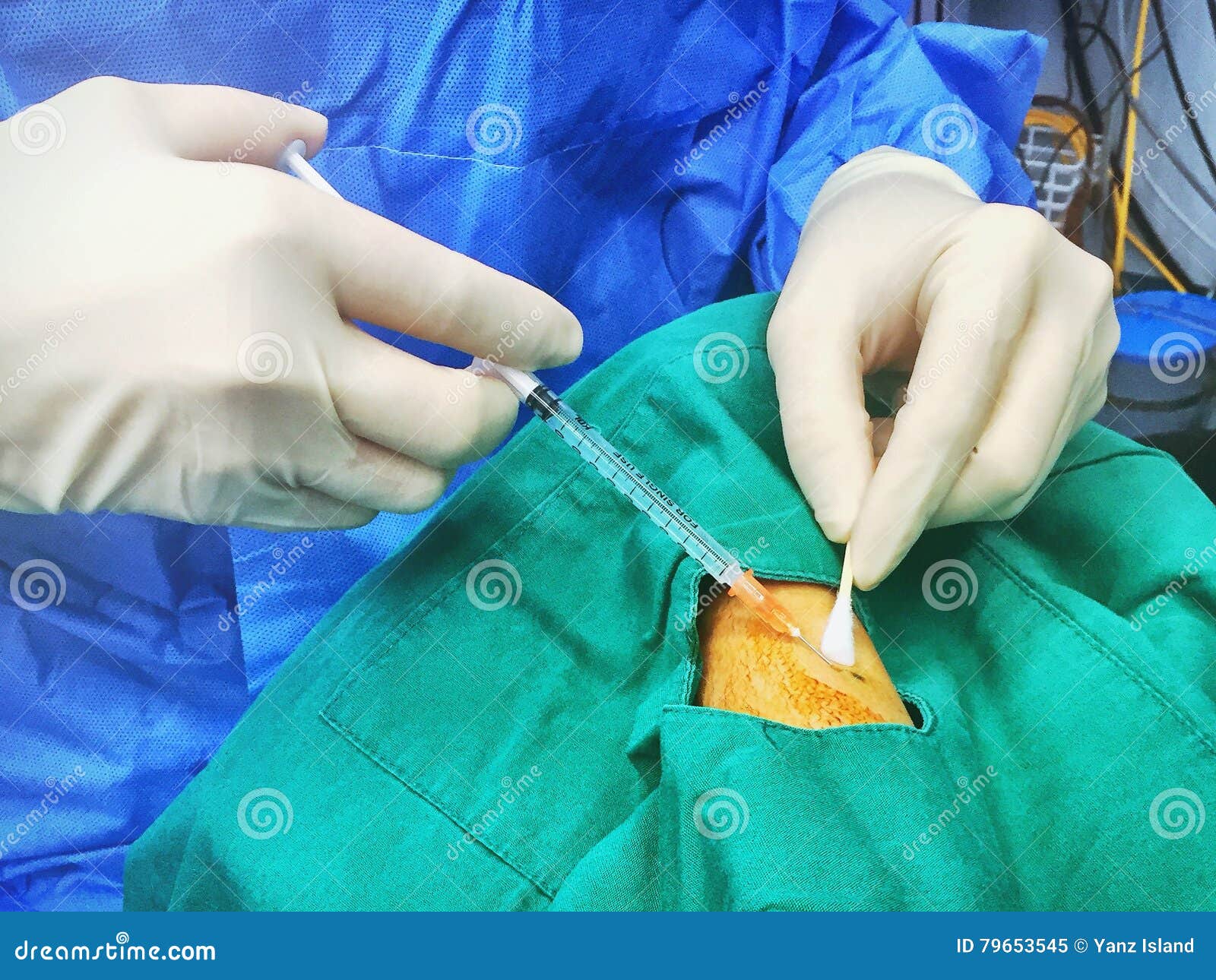 Medical surgery stock image. Image of nurse, medicine - 79653545