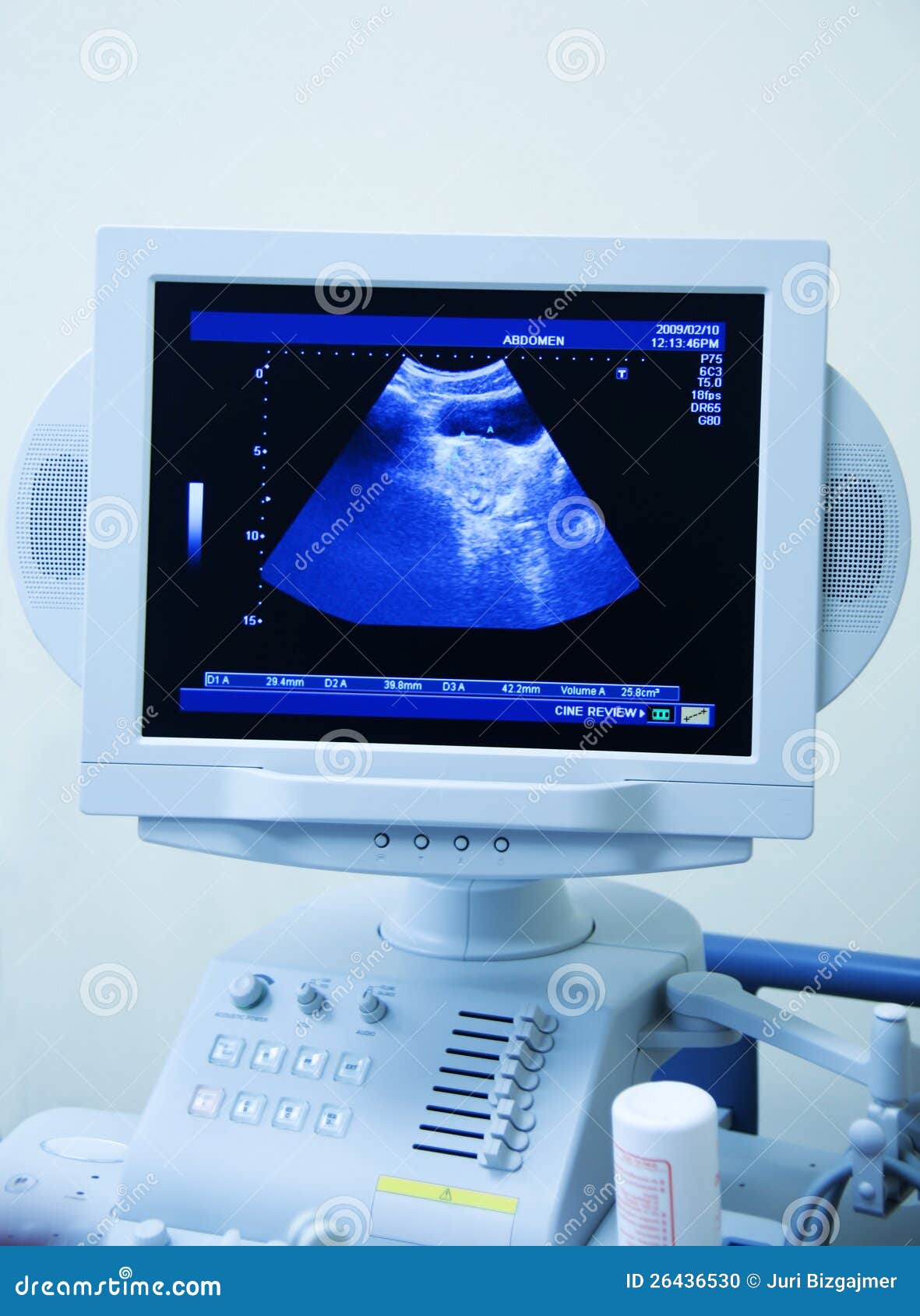 Medical ultrasonic device stock photo. Image of life - 26436530