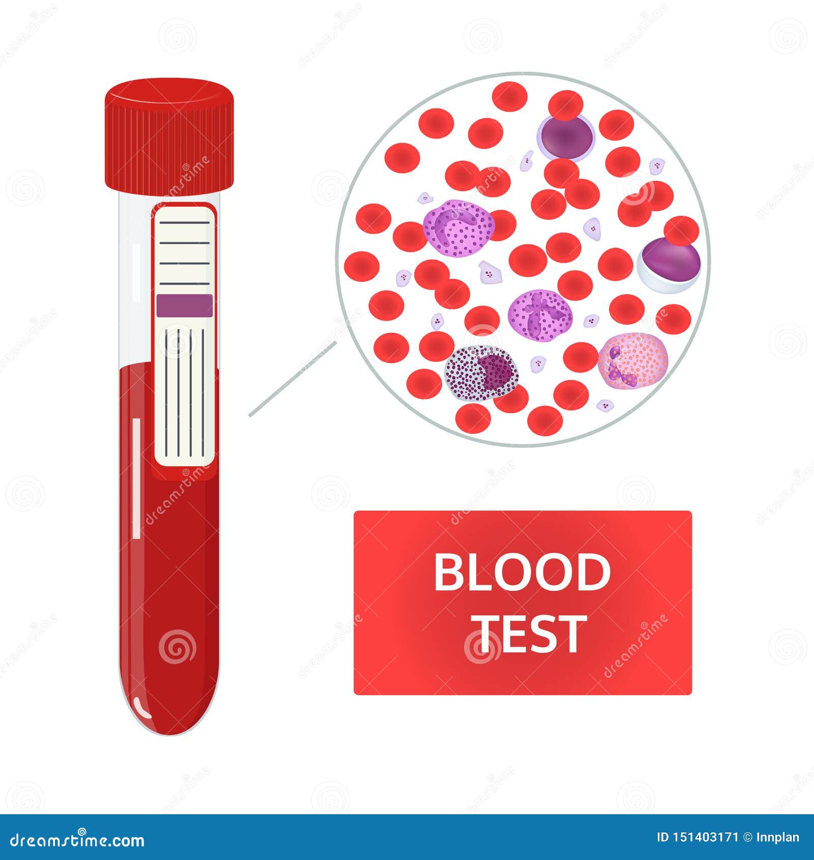 Composition of Blood in Microscope. Blood Test. Vector Image Stock ...