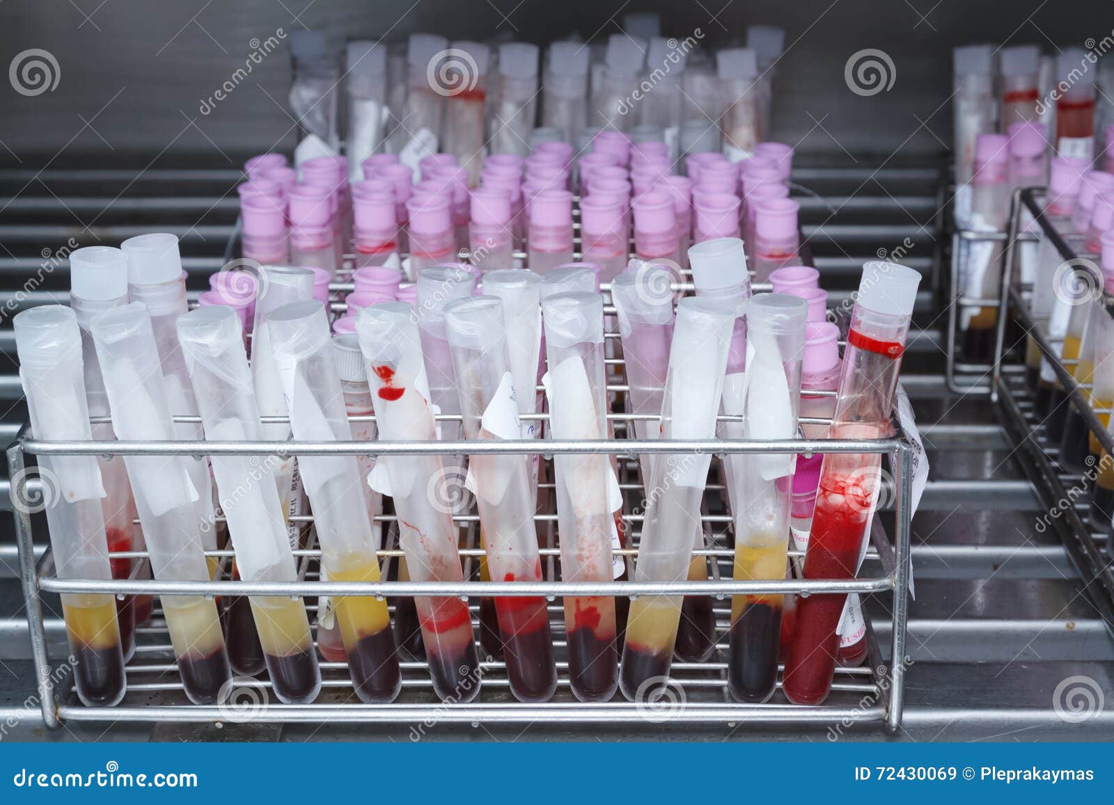 Medical Waste ,blood Sample Tubes Stock Image - Image of healthcare ...