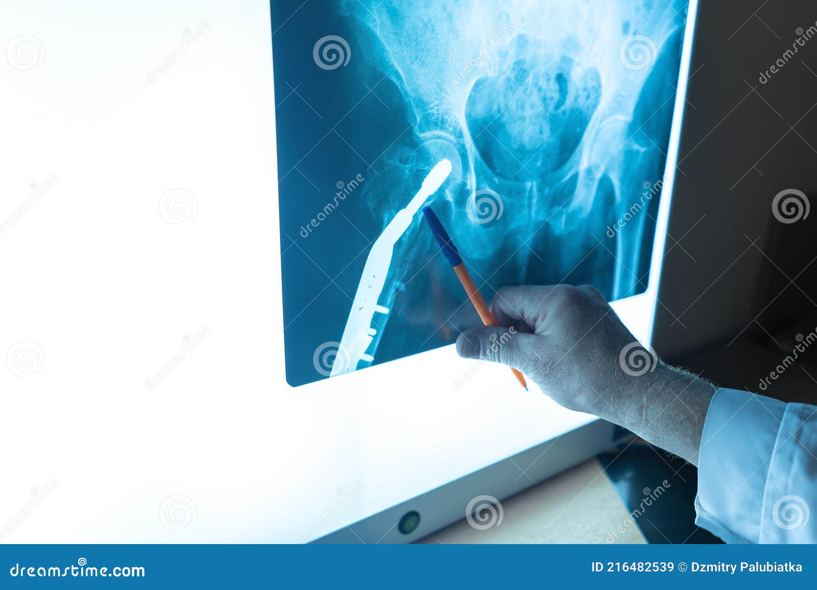 Medical Workers in Hospital Examine X-ray Prints Stock Image - Image of ...