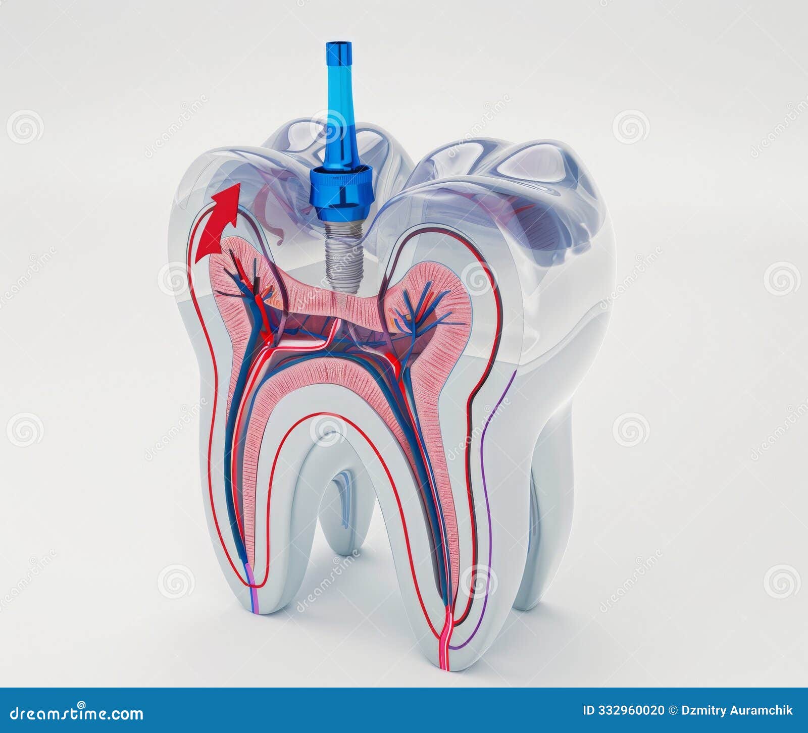 This is a Medically Accurate 3D Illustration of the Root Canal ...
