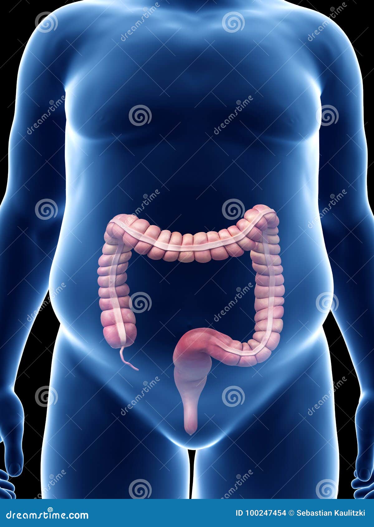 An obese guys colon stock illustration. Illustration of rendering ...