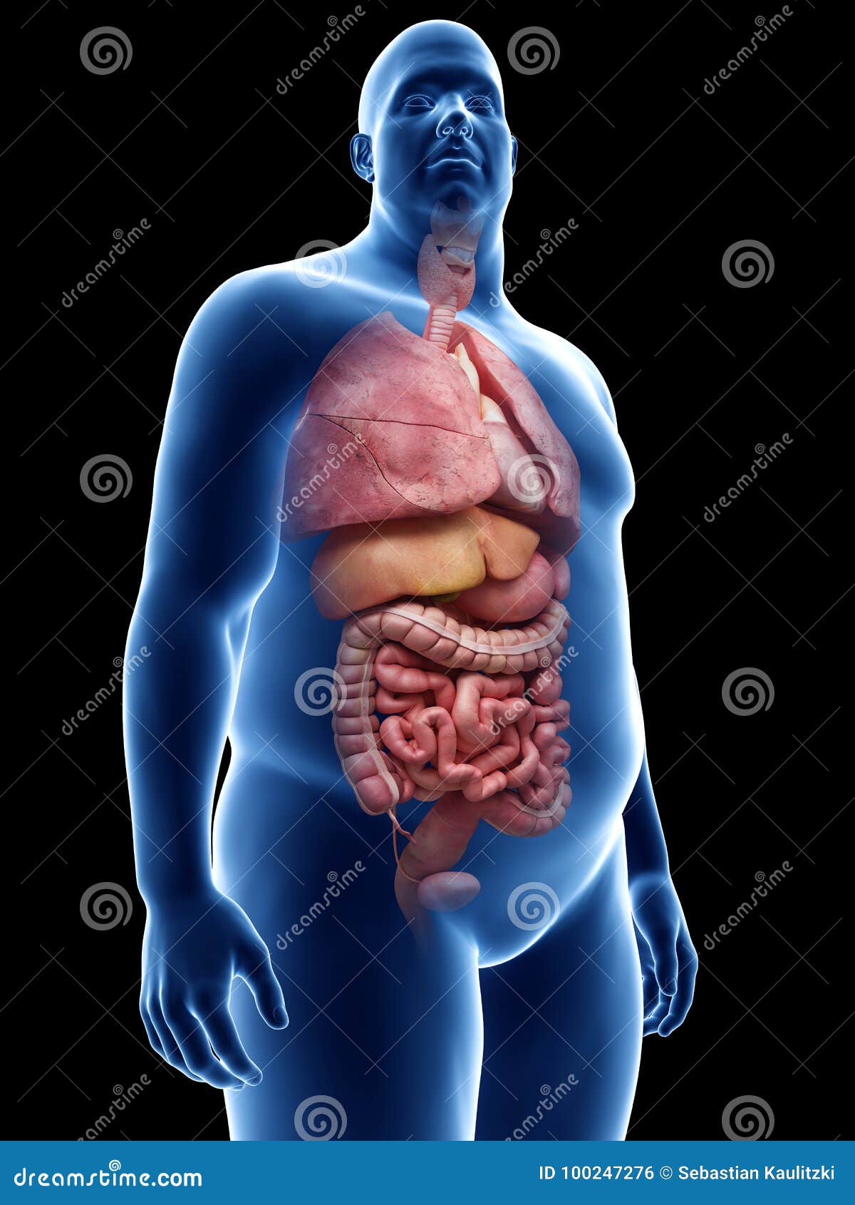 Organs In Obese Human Body Vector Illustration | CartoonDealer.com ...