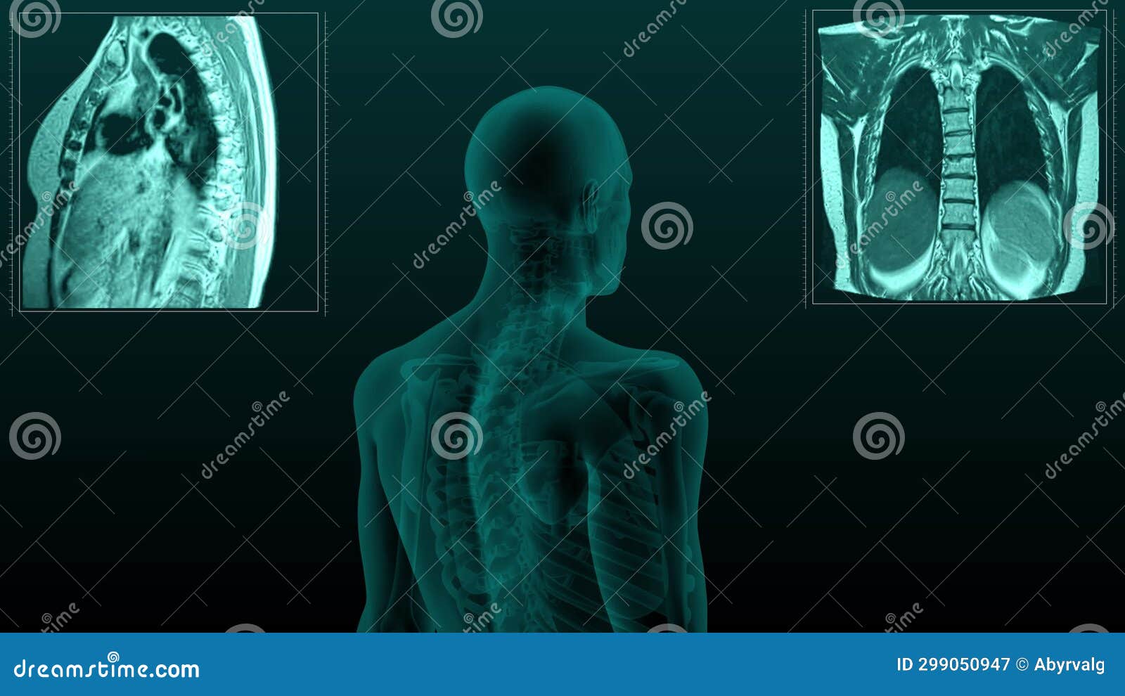 A Medically Anatomically Correct Magnetic Resonance Scan Organs of the ...