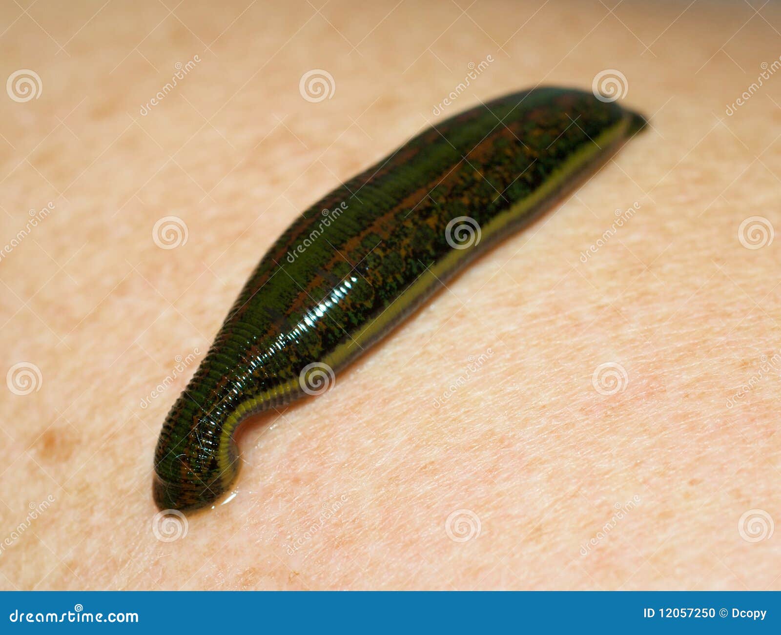 Hirudo Medicinalis Microscope