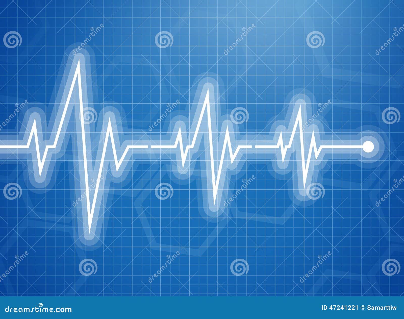 Medicinsk Design - Kardiogram Vektor Illustrationer - Illustration av ...