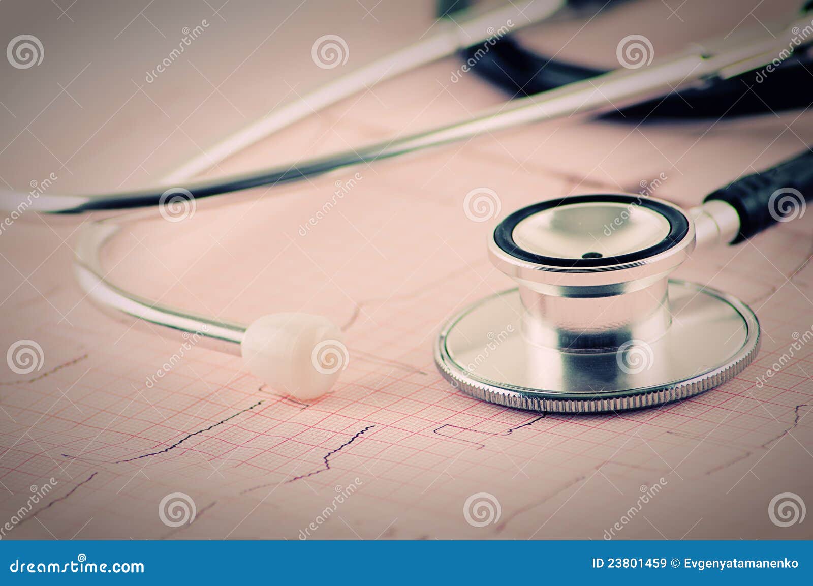 Medische Stethoscoop Op Elektrocardiogram Stock Afbeelding - Image of ...