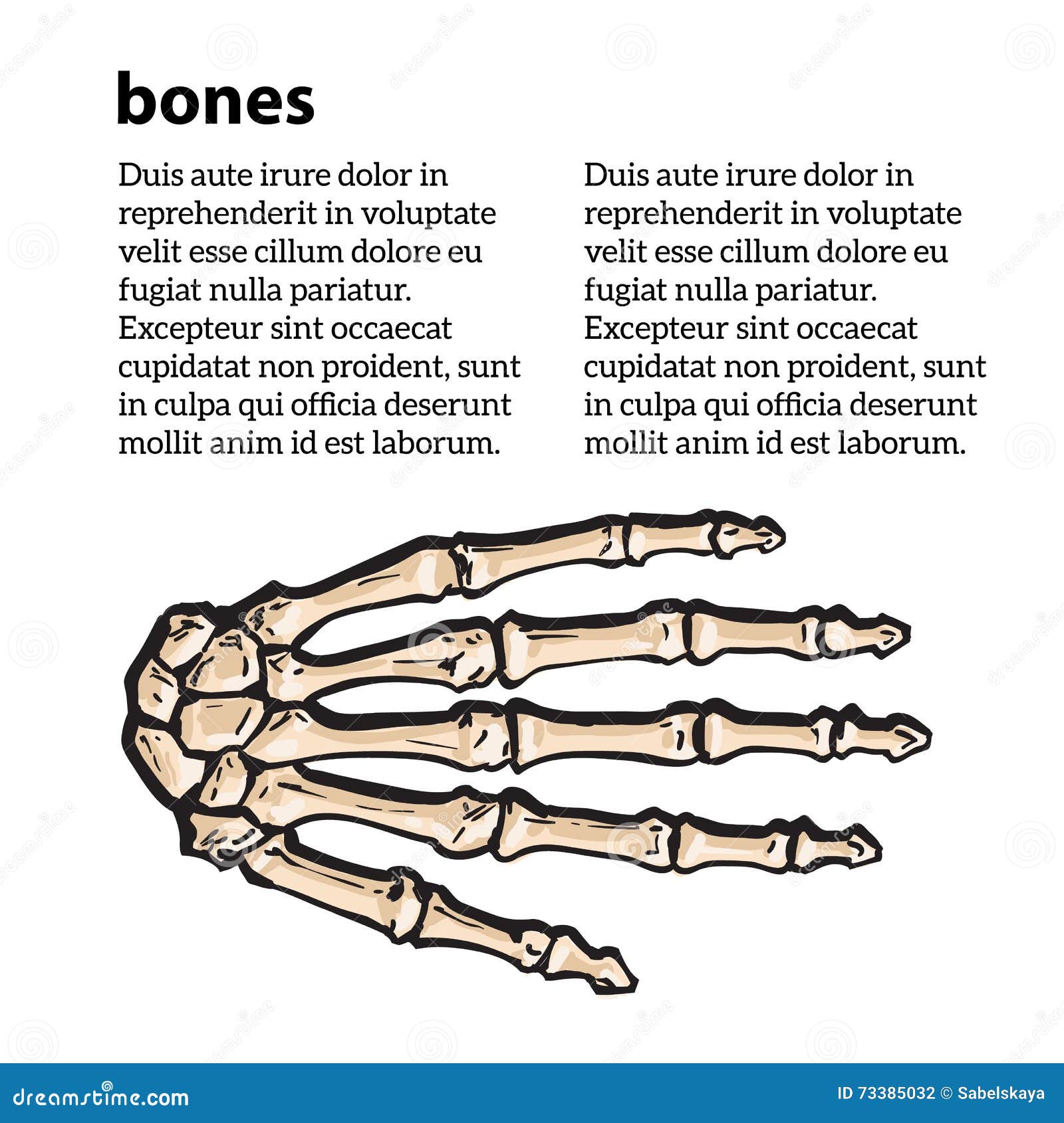 Medizinisch Genaue Illustration Der Handknochen Vektor Abbildung ...