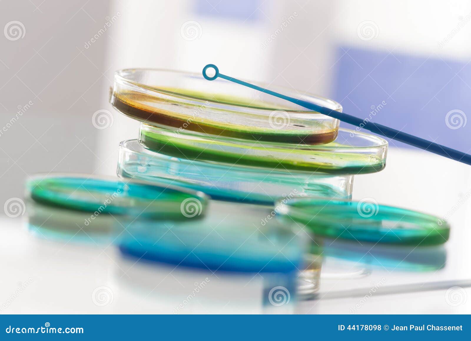 Medizinisch: Sterile Urinprobe Und Blutprobe Stockfoto - Bild von ...