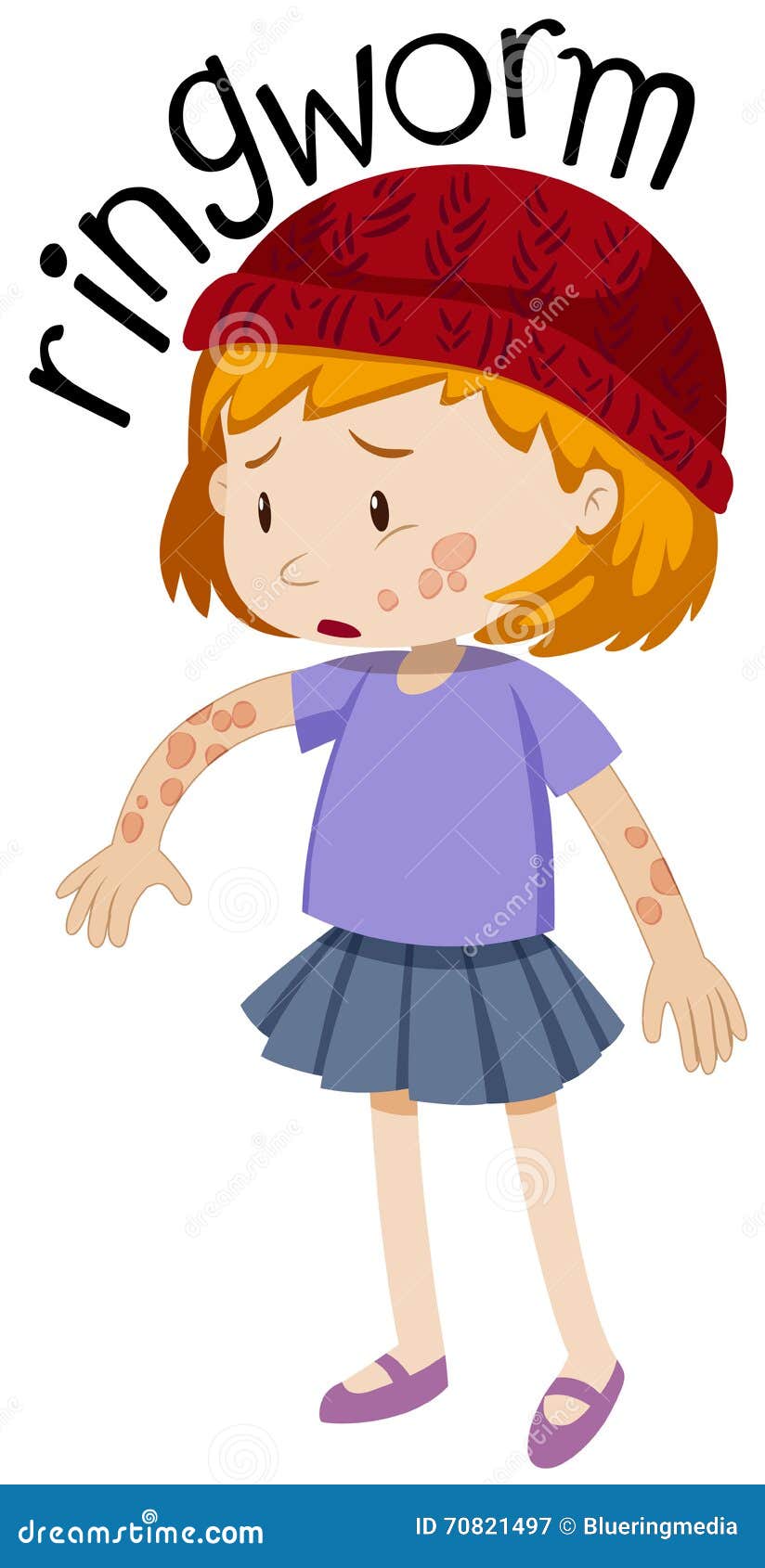 Meisje Met Ringworm Op Lichaam Vector Illustratie - Illustration of ...