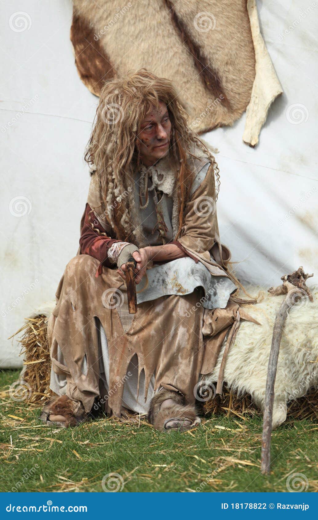 Melaatse vrouw redactionele fotografie. Image of vuil - 18178822