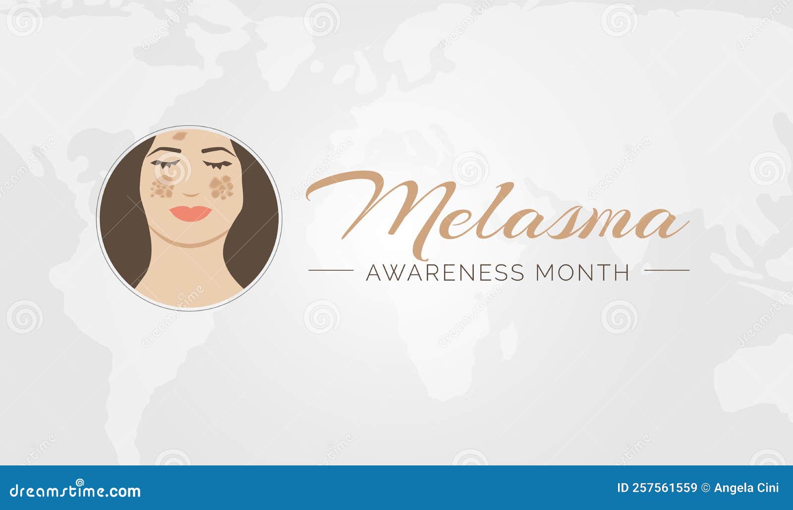 Melasma Illustration Cartoon Vector | CartoonDealer.com #98801415